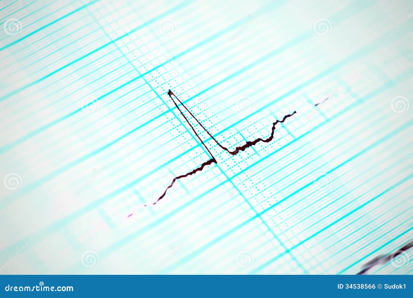 Heartbeat in motion stock photo. Image of healthy, loss - 34538566