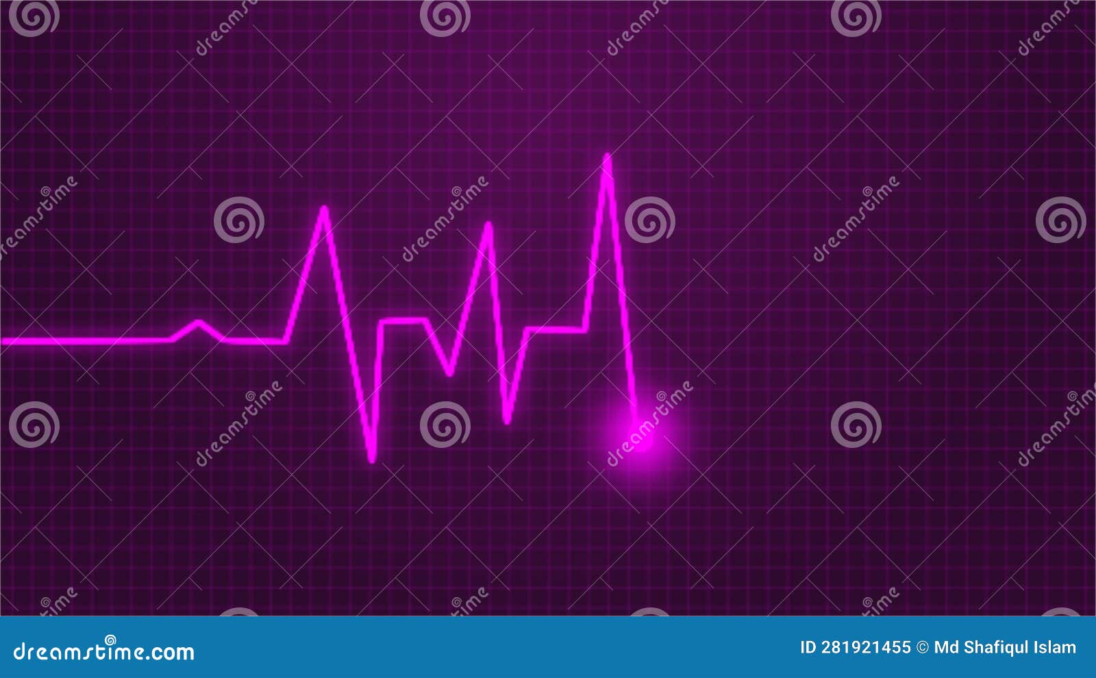 Heartbeat Pattern. Cardiogram in Blue. Electrocardiogram Stock ...