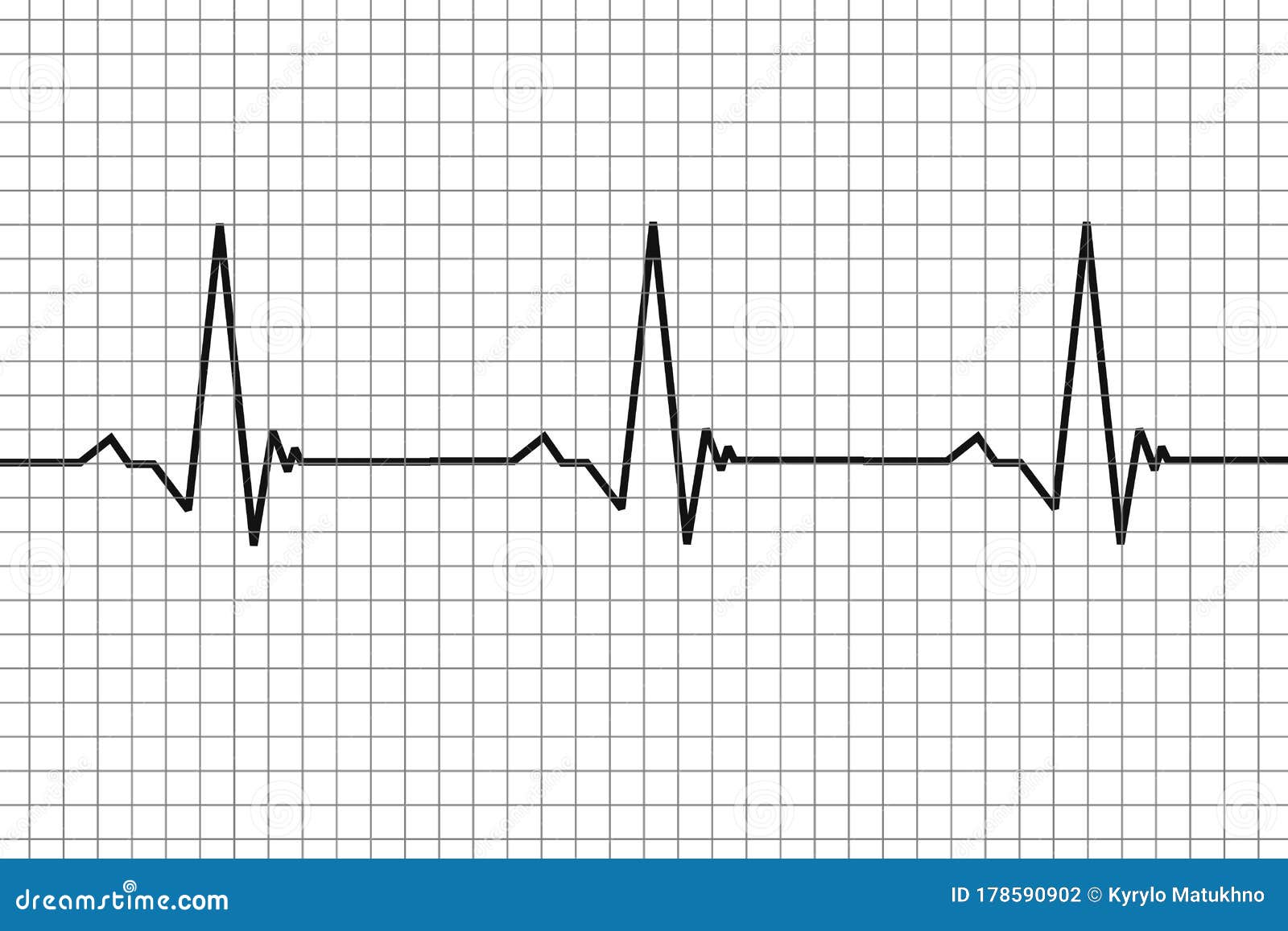 Heartbeat. Pulse Simple Illustration. Simple Illustration Concept Stock ...