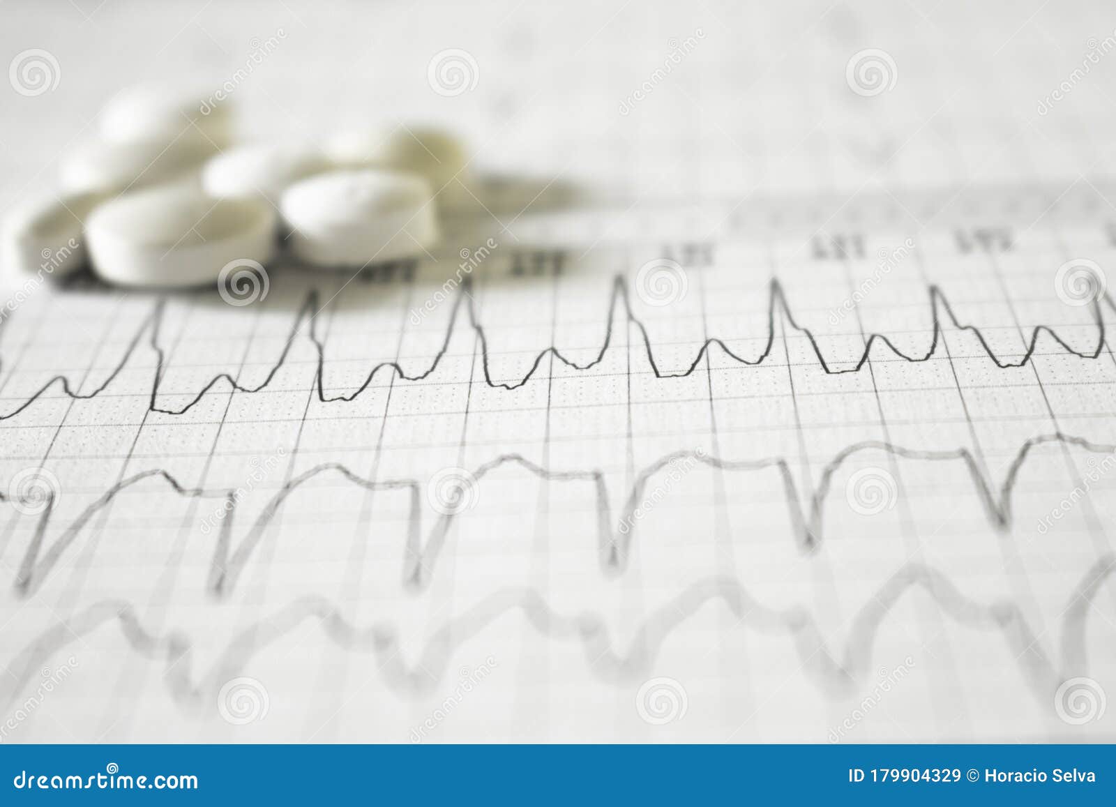 Heartbeat Represented On Paper Electrocardiogram With Selective Focus