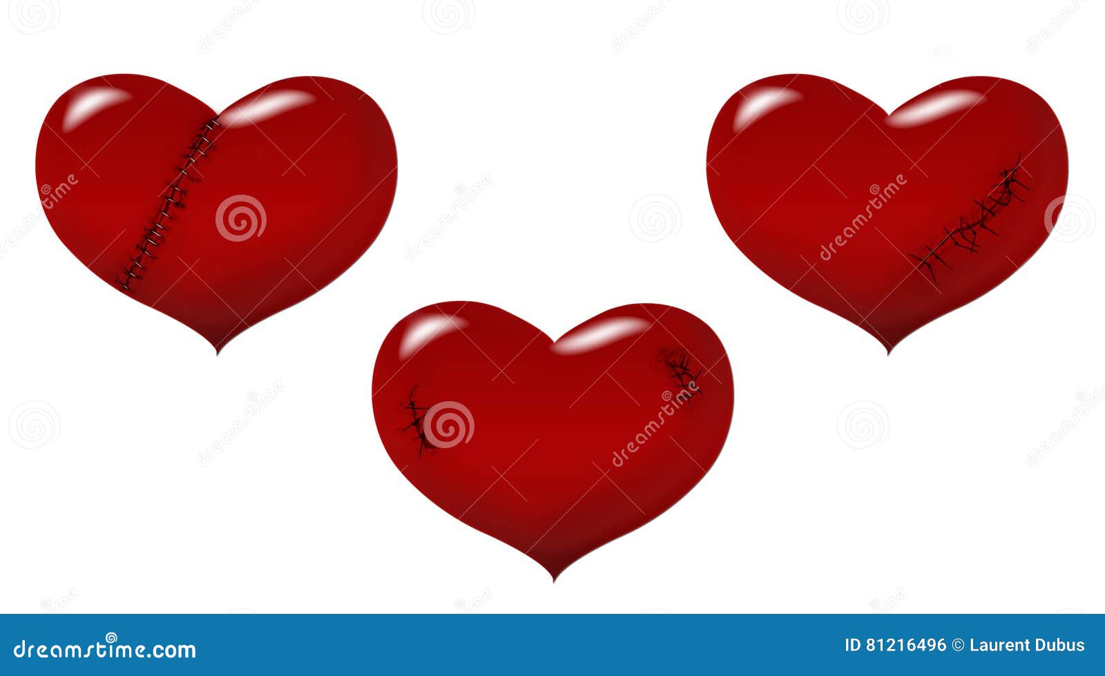 Hearts Scars Royalty-Free Stock Image | CartoonDealer.com #81216496