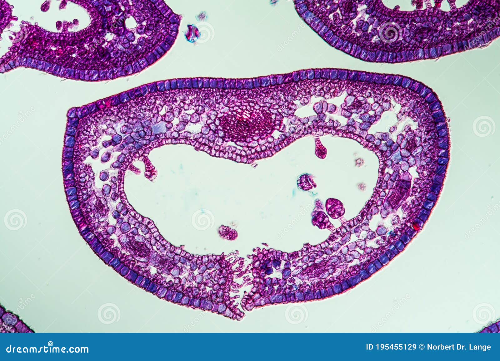 Heather Leaf Cross Section Under the Microscope, Stock Image - Image of ...