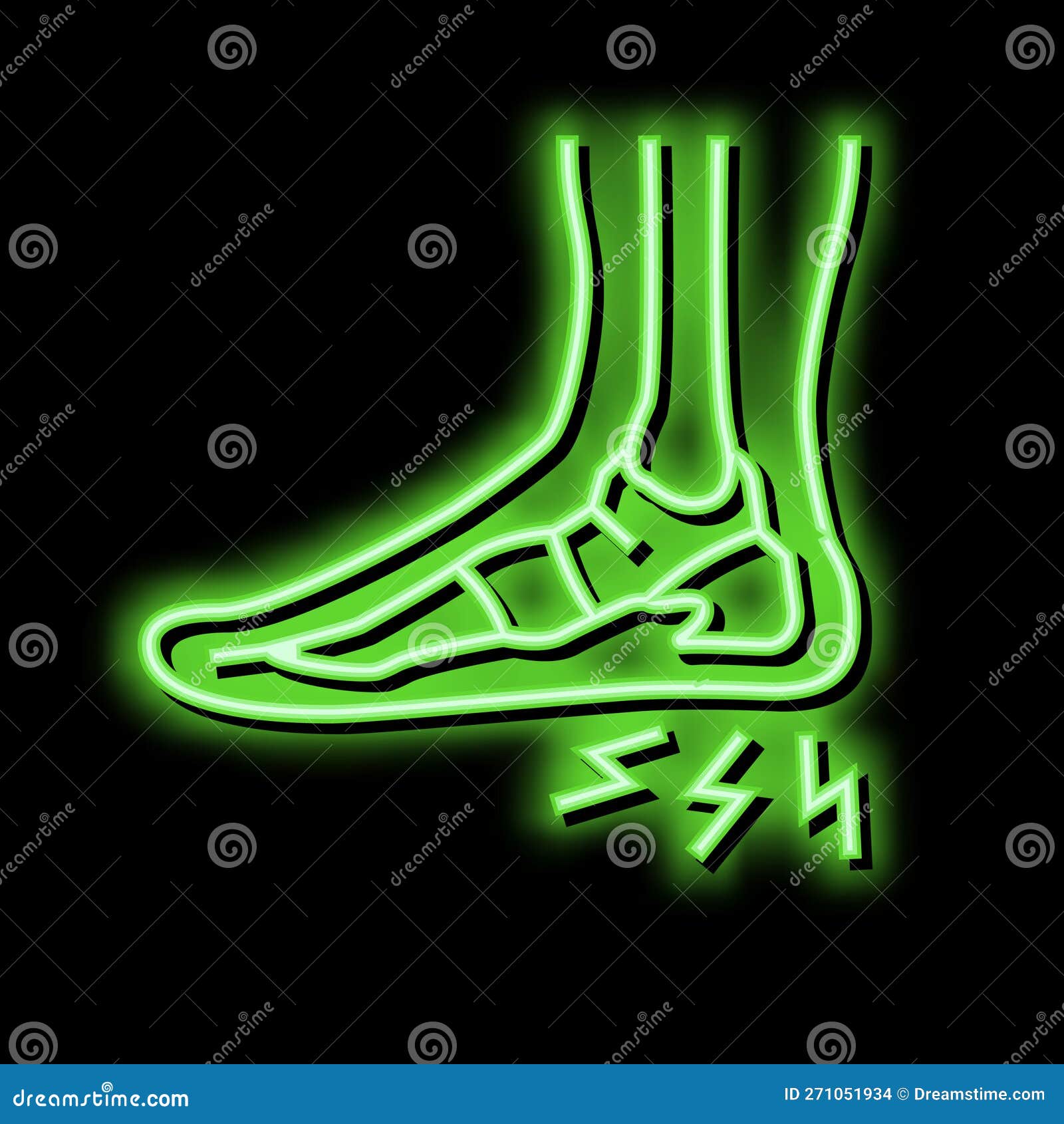 Heel Spur Disease Neon Glow Icon Illustration Stock Vector ...