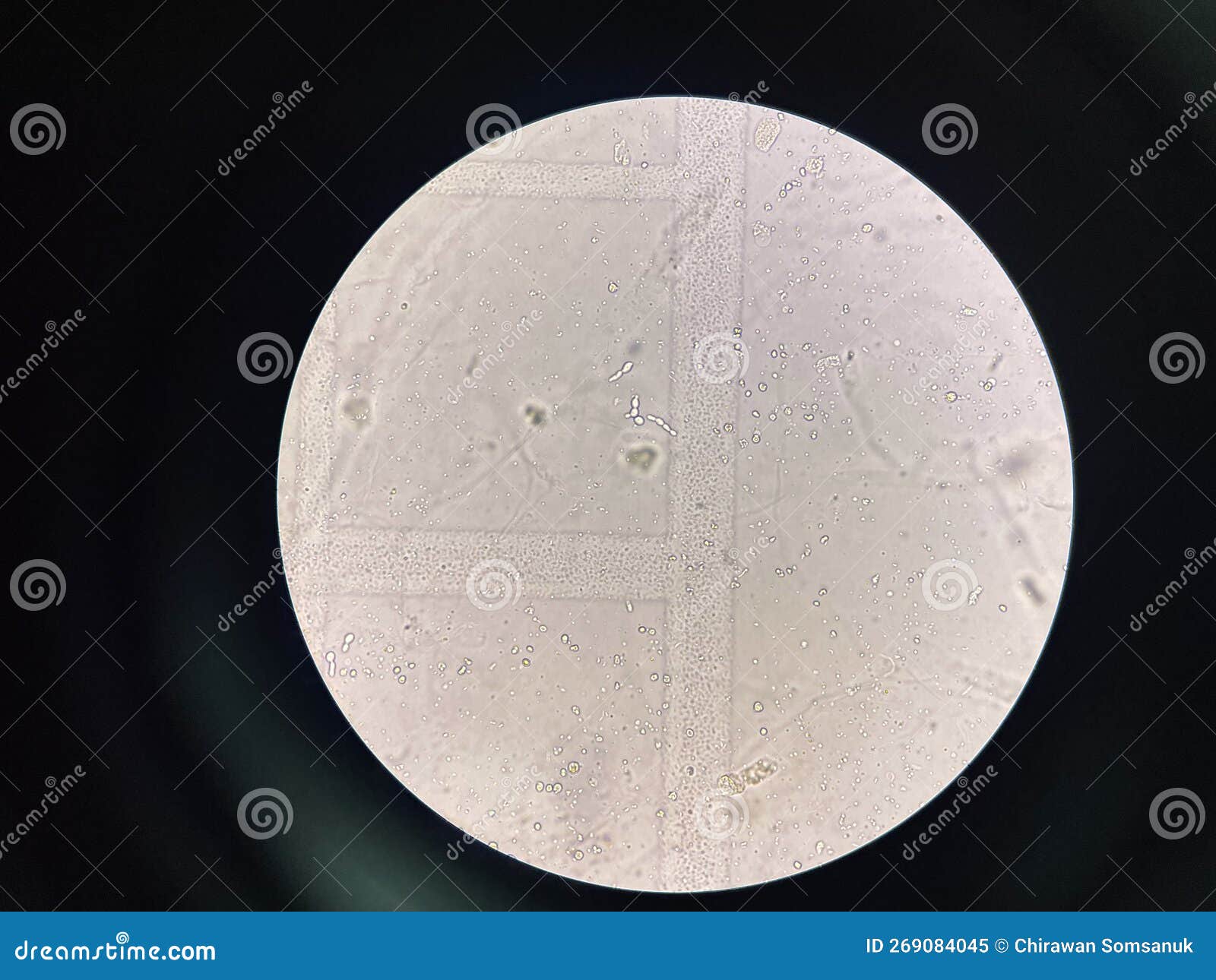 Hefebild Mit Pseudo-Hephain Im Urin Stockbild - Bild von bier, medizin ...