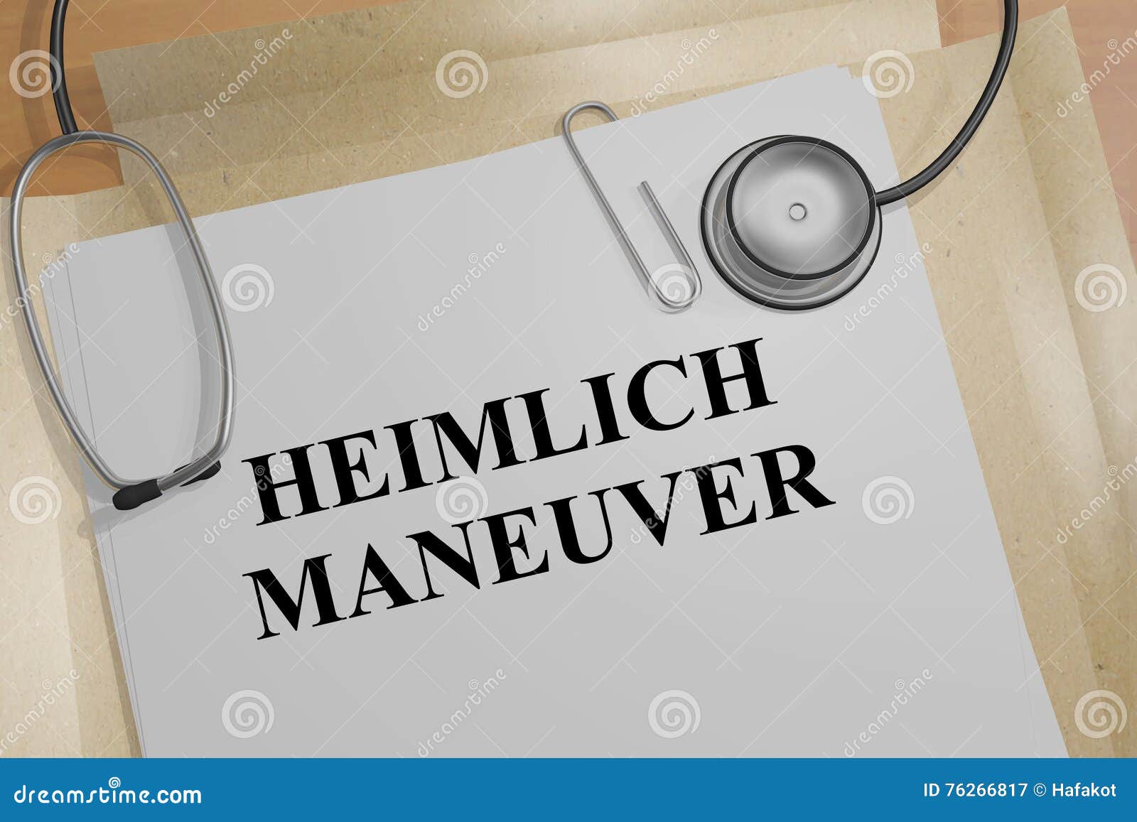Heimlichmanoeuvre - Medisch Concept Stock Illustratie - Illustration of ...