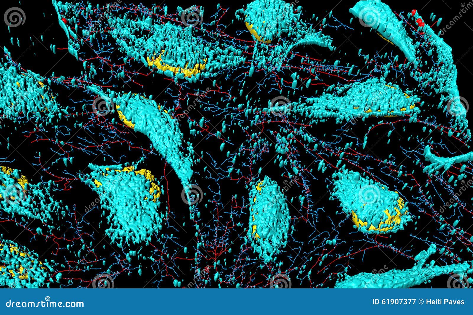 Cancer Cells Under A Microscope. Tissues Affected By Cancer Cells Under ...