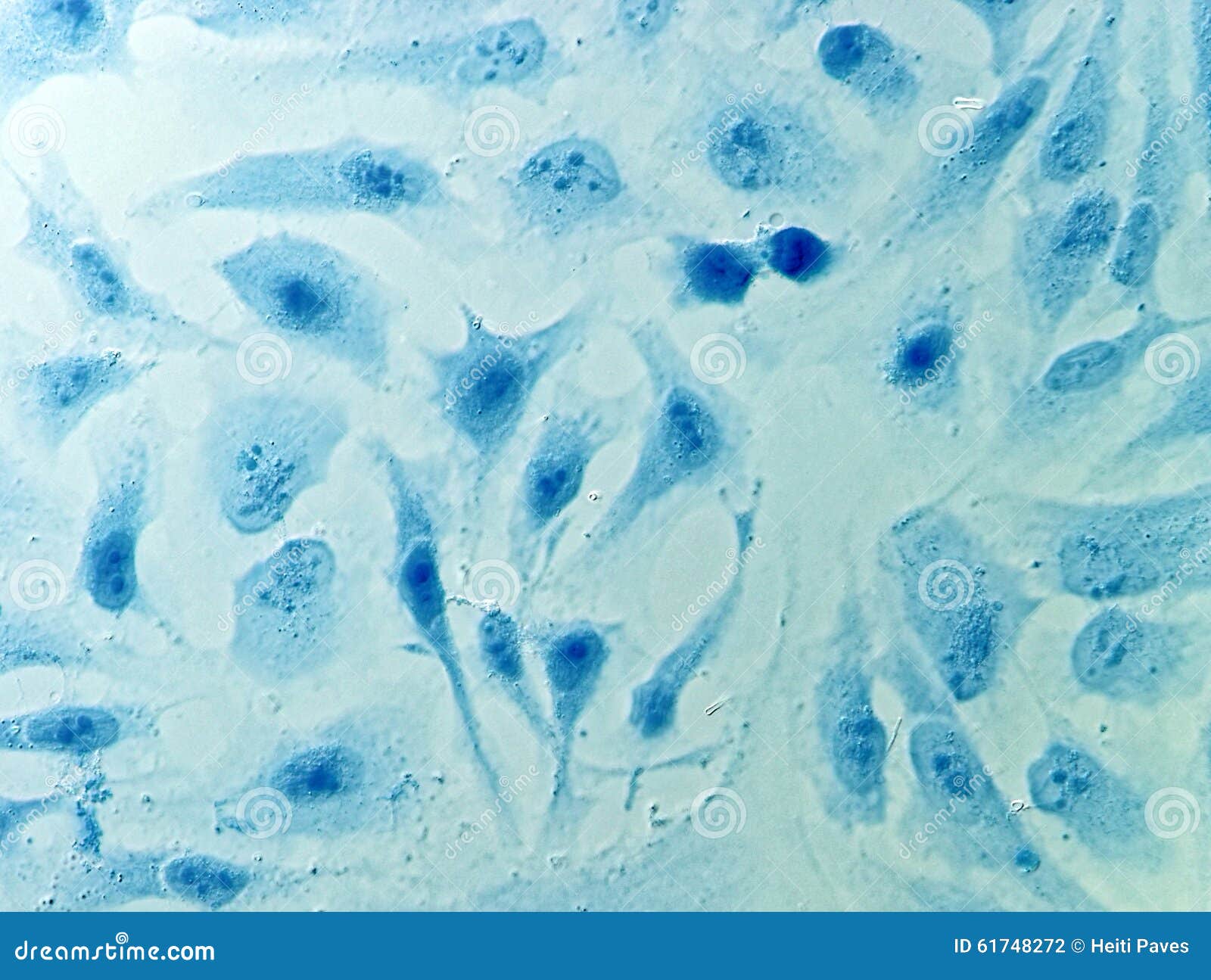 HeLa cervical cancer cells stock photo. Image of proliferation - 61748272