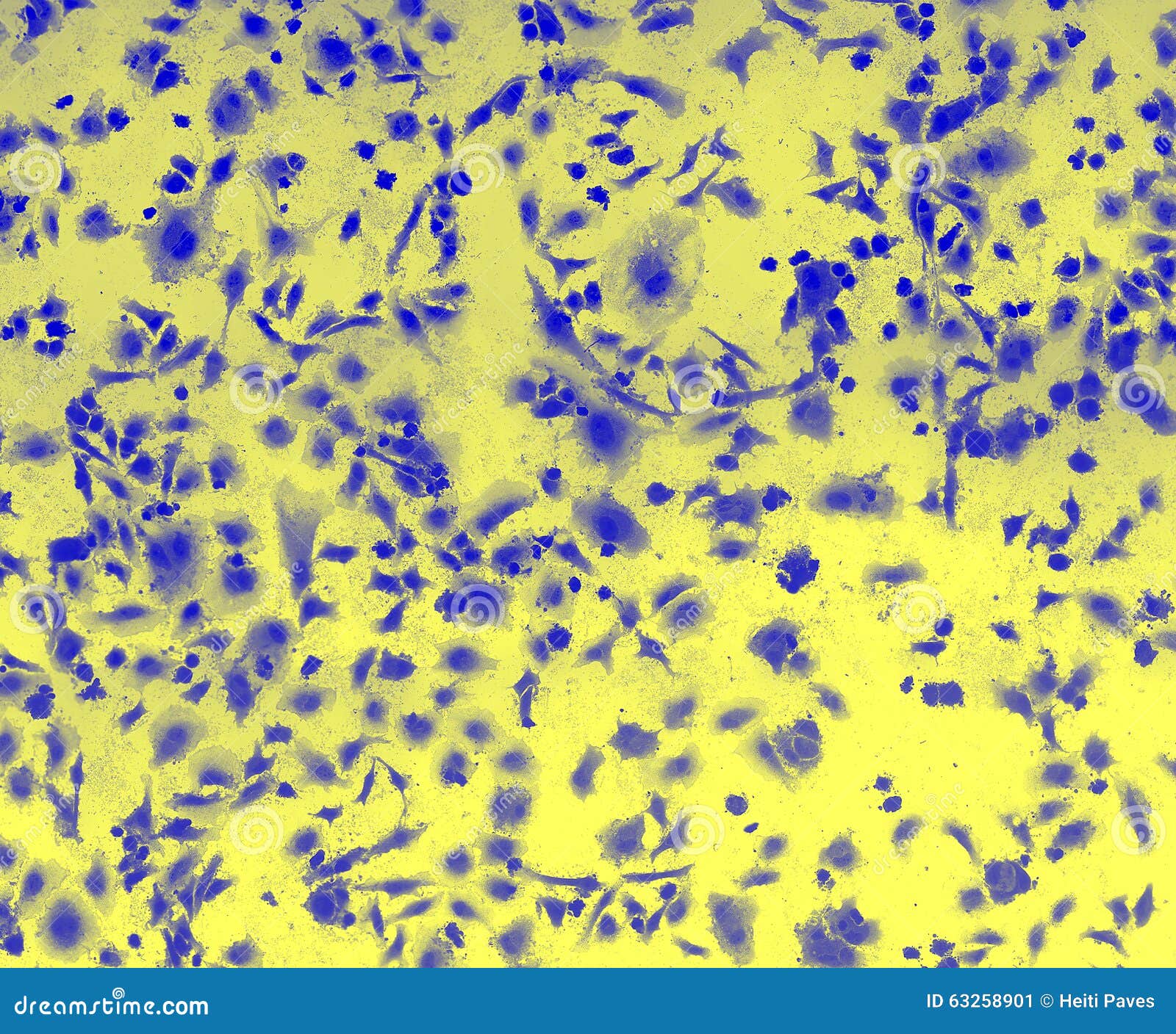 Cancer Cells Under Microscope