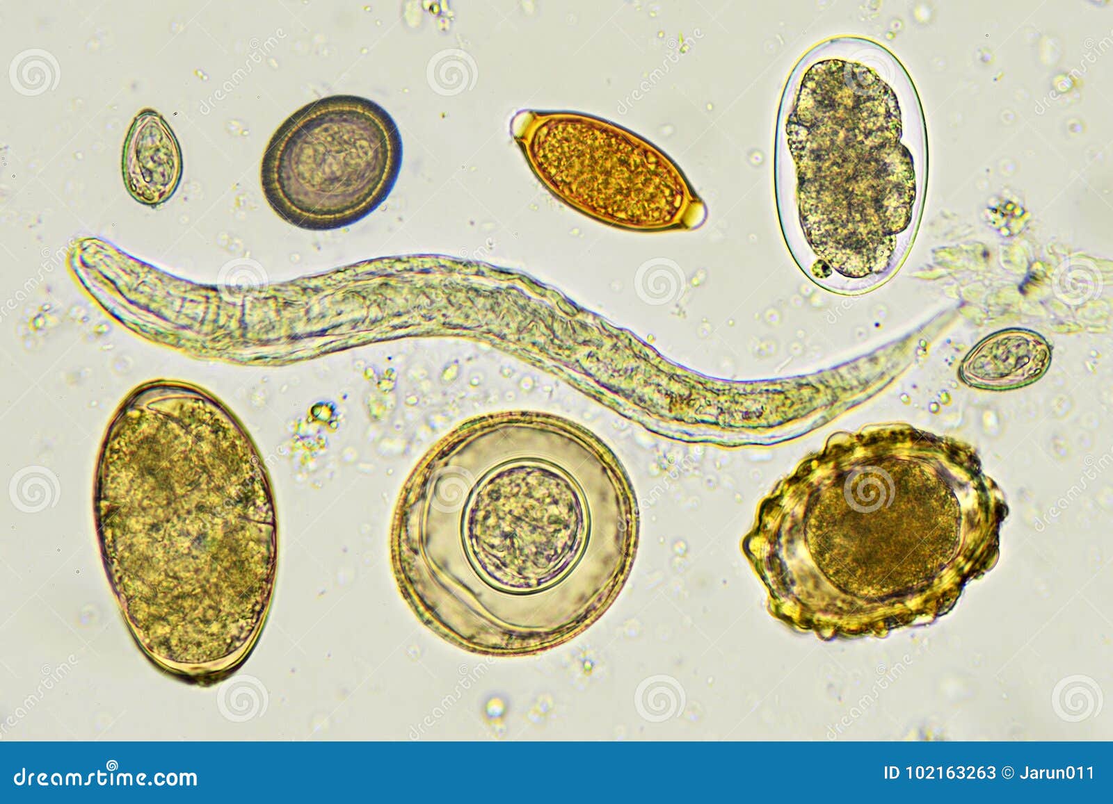 Helminthes in stool stock image. Image of fecal, laboratory - 102163263