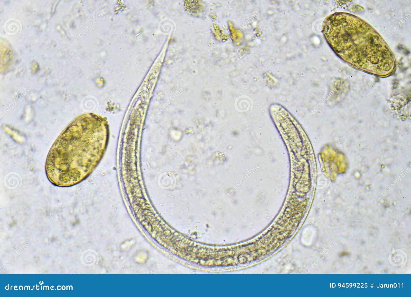 Helminthes stock image. Image of helminthes, technology - 94599225