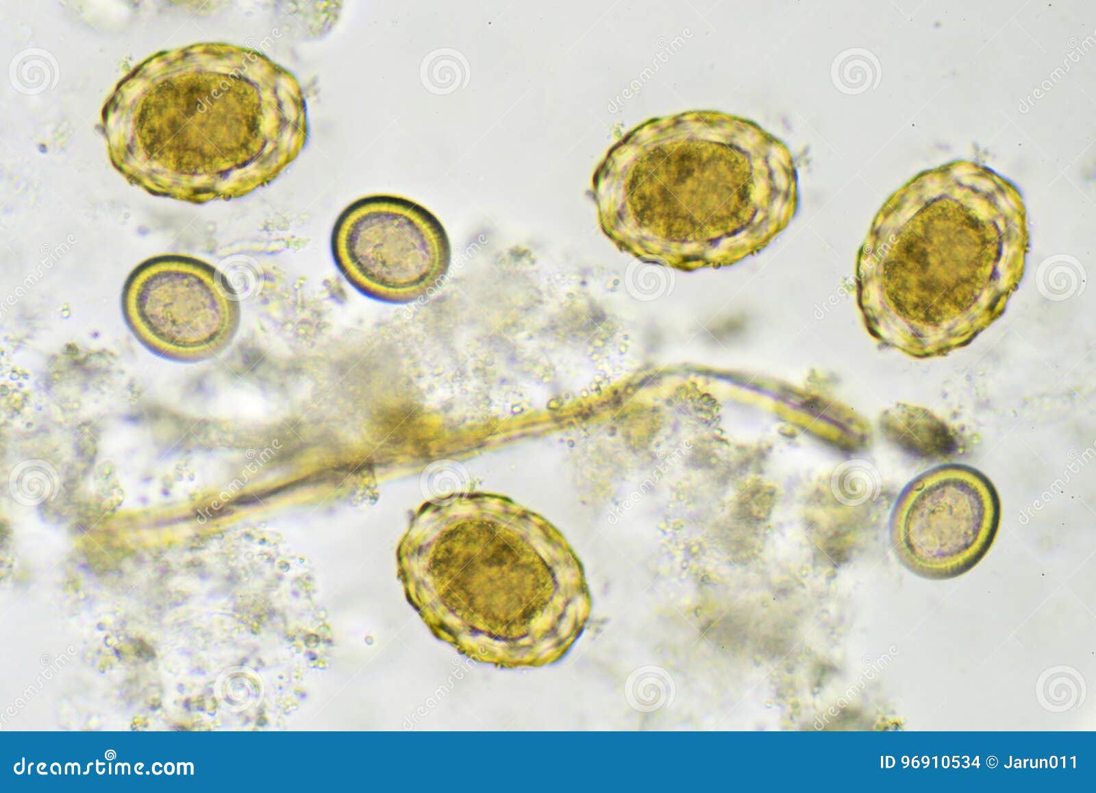 Helminthes in stool stock photo. Image of hookworm, organism - 96910534