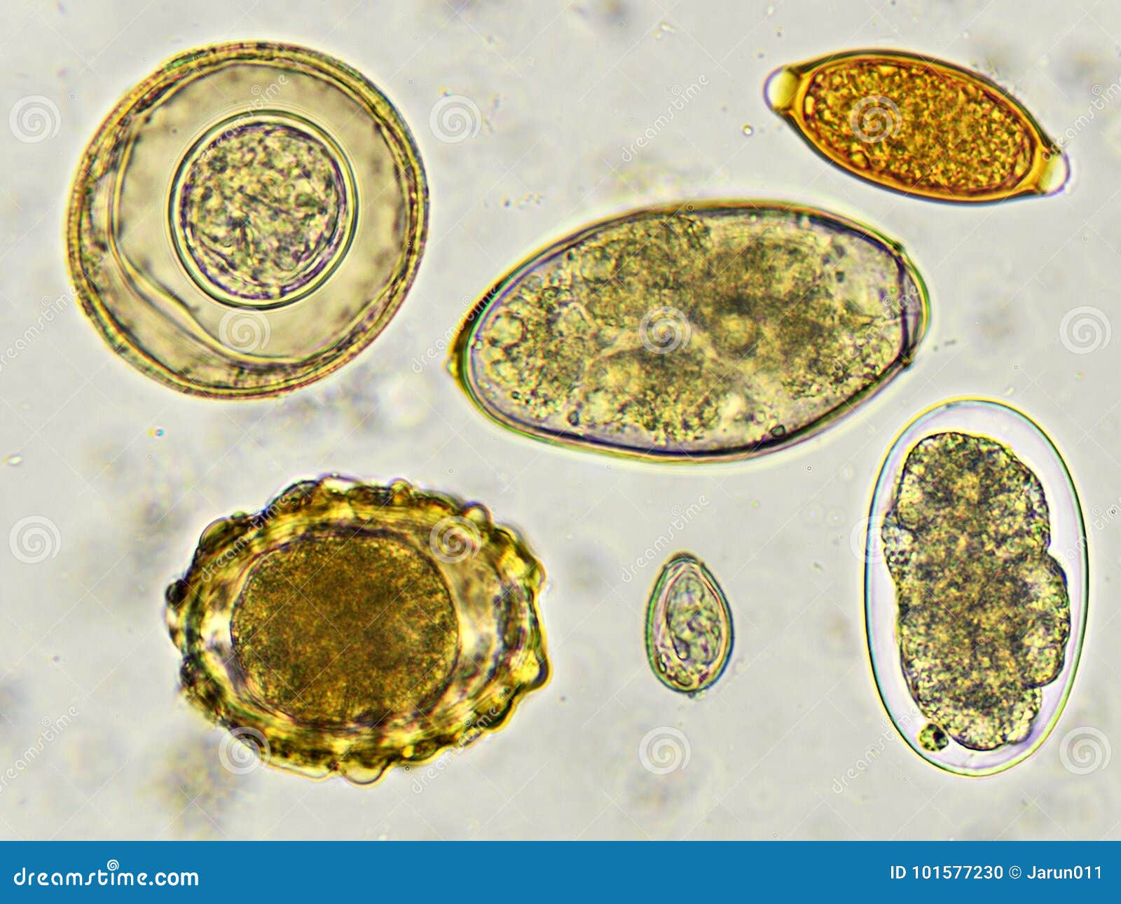 Helminthes in stool stock photo. Image of hookworm, laboratory - 101577230