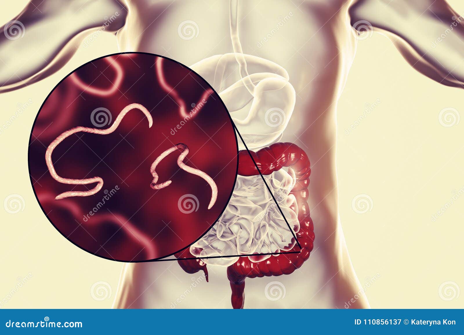 Helminths Nematodes Enterobius in the Gut Stock Illustration ...