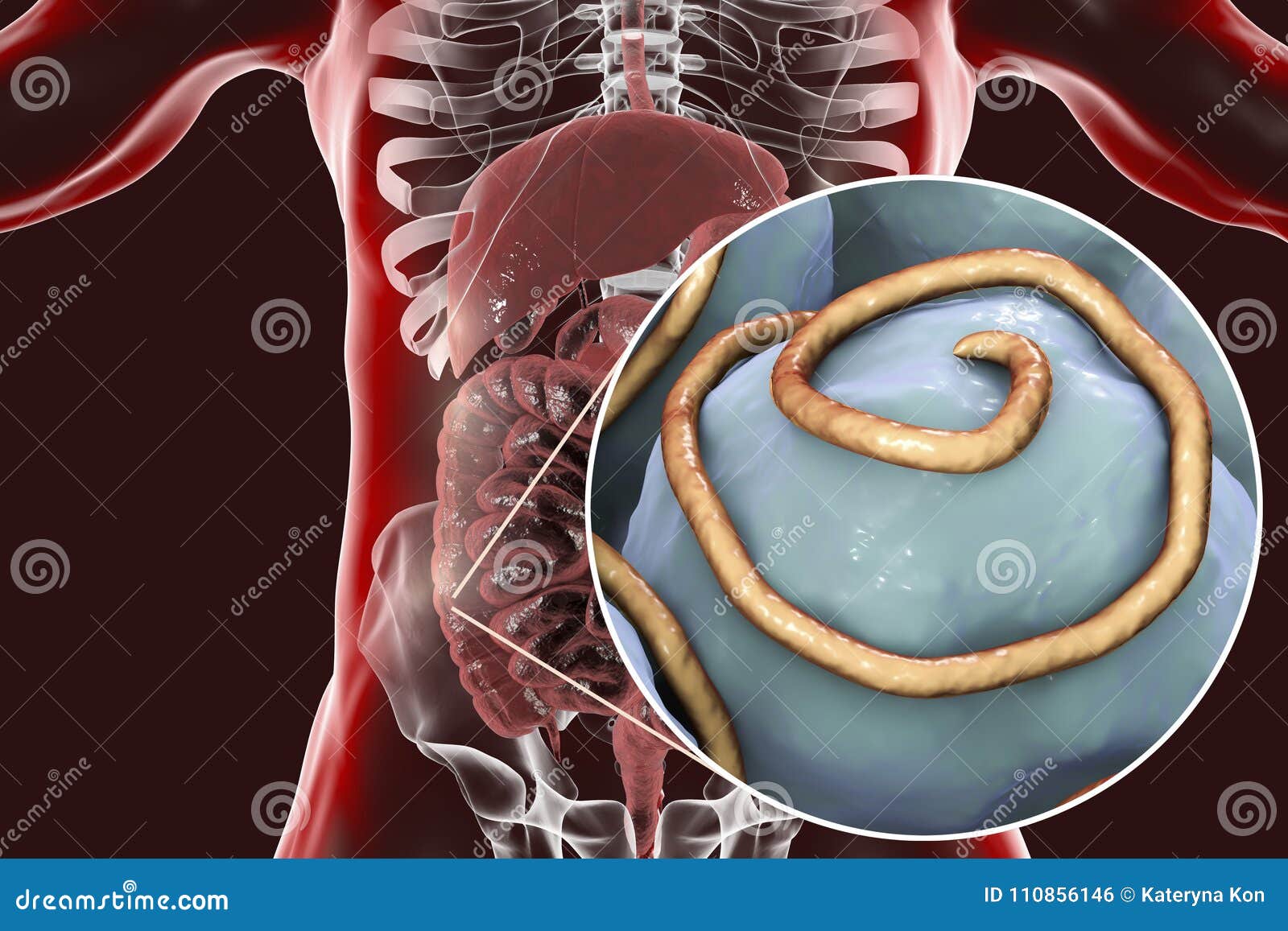 Helminths Nematodes Enterobius in the Gut Stock Illustration ...