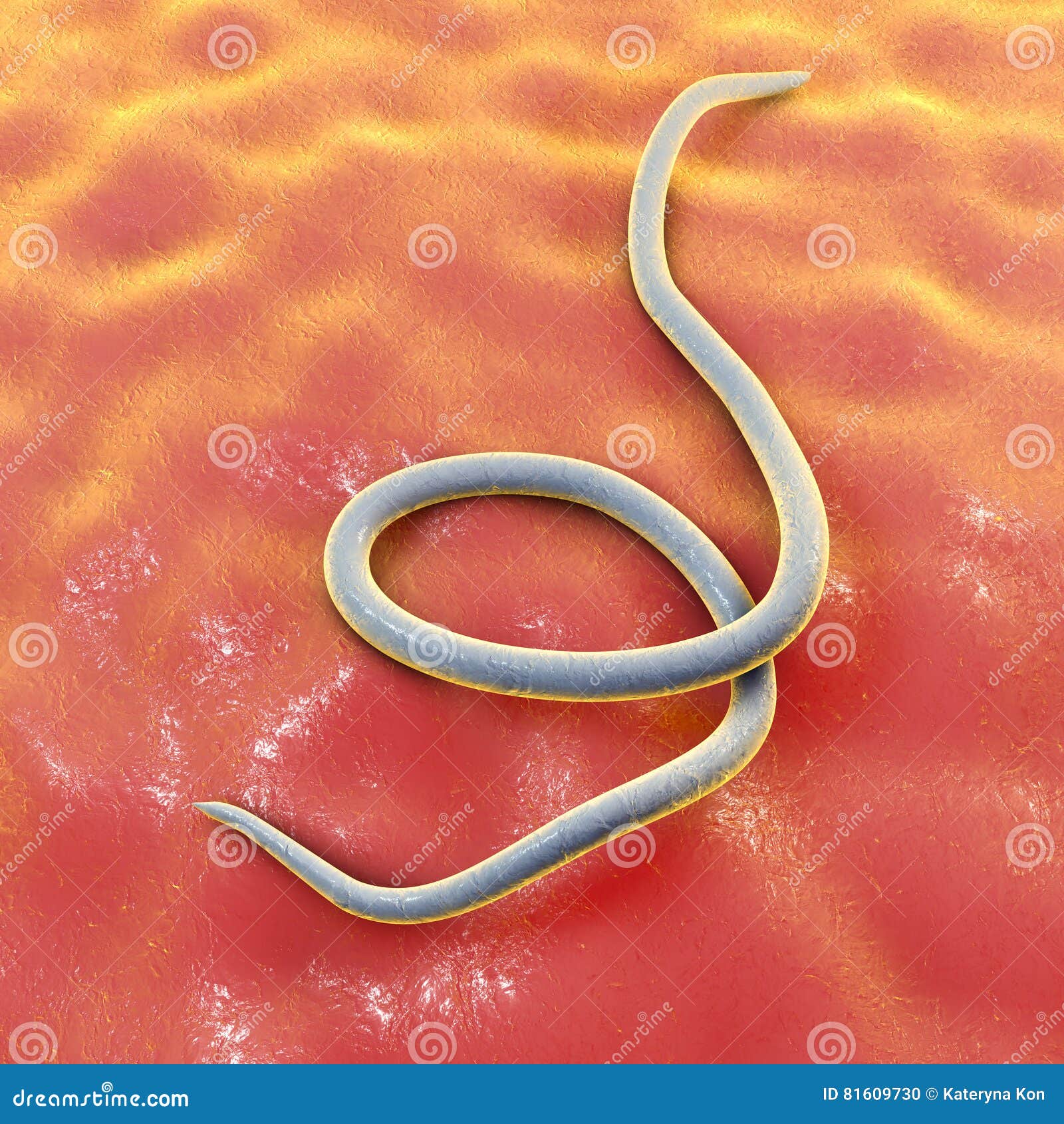 Helminths Nematodes Enterobius Royalty-Free Cartoon | CartoonDealer.com ...