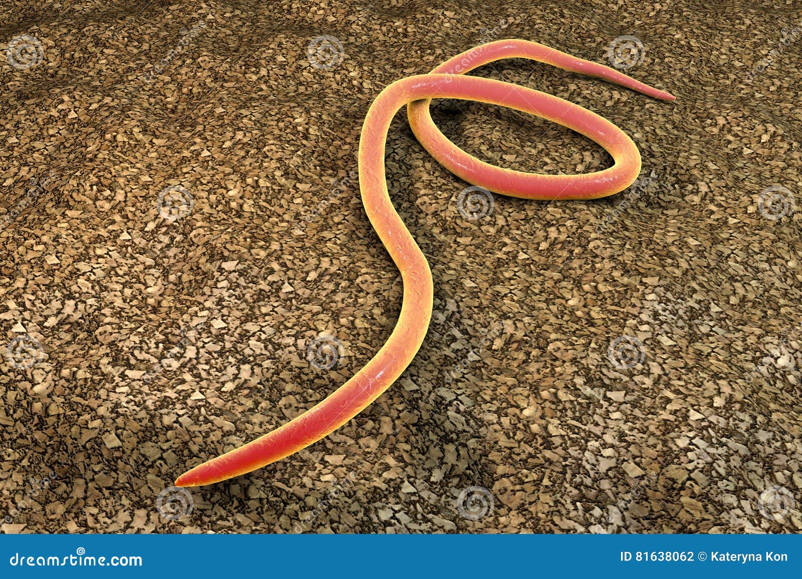 Helminths Nematodes Enterobius Stock Illustration - Illustration of ...