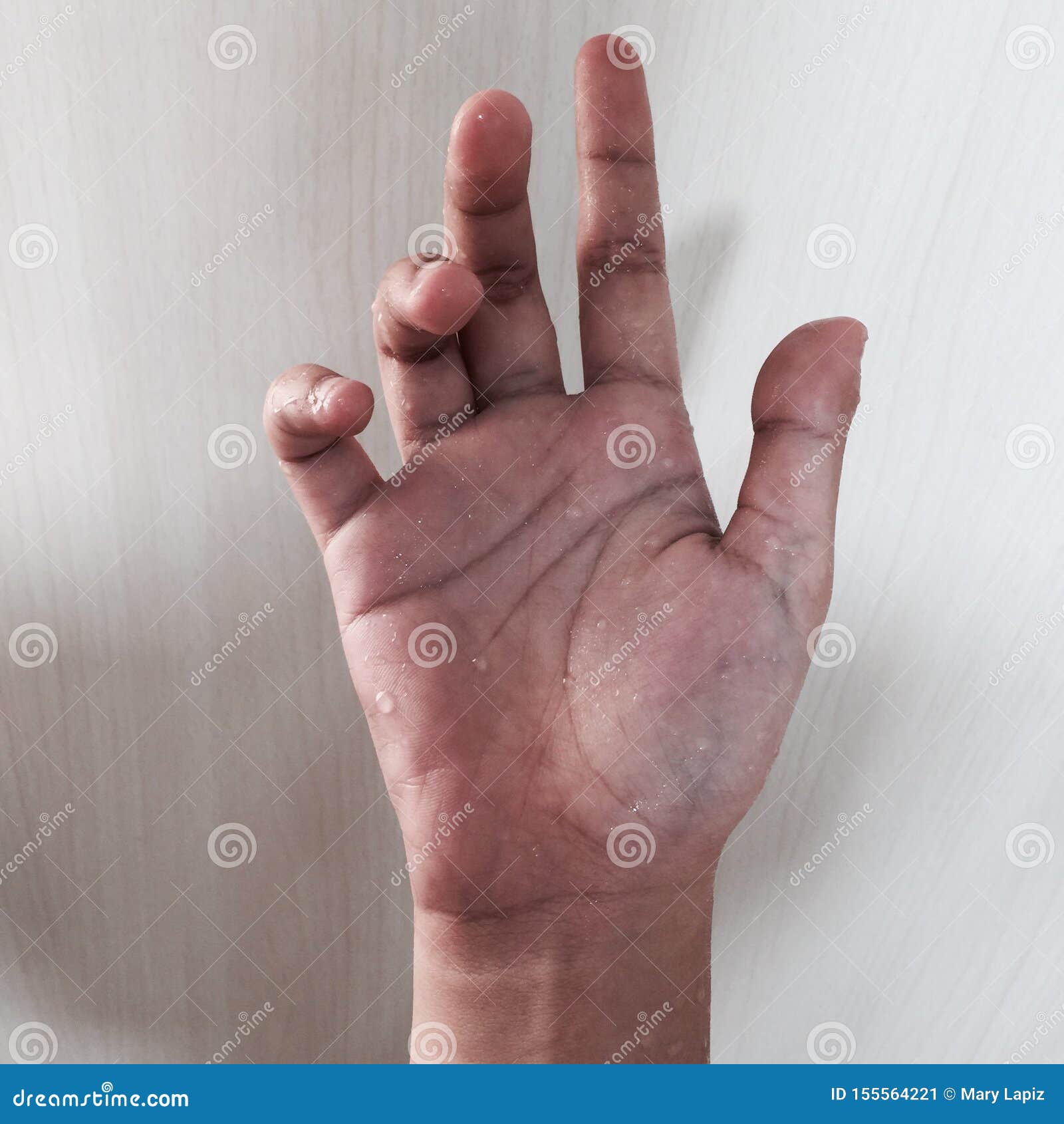 Helpless stock image. Image of drown, body, veins, hurt - 155564221