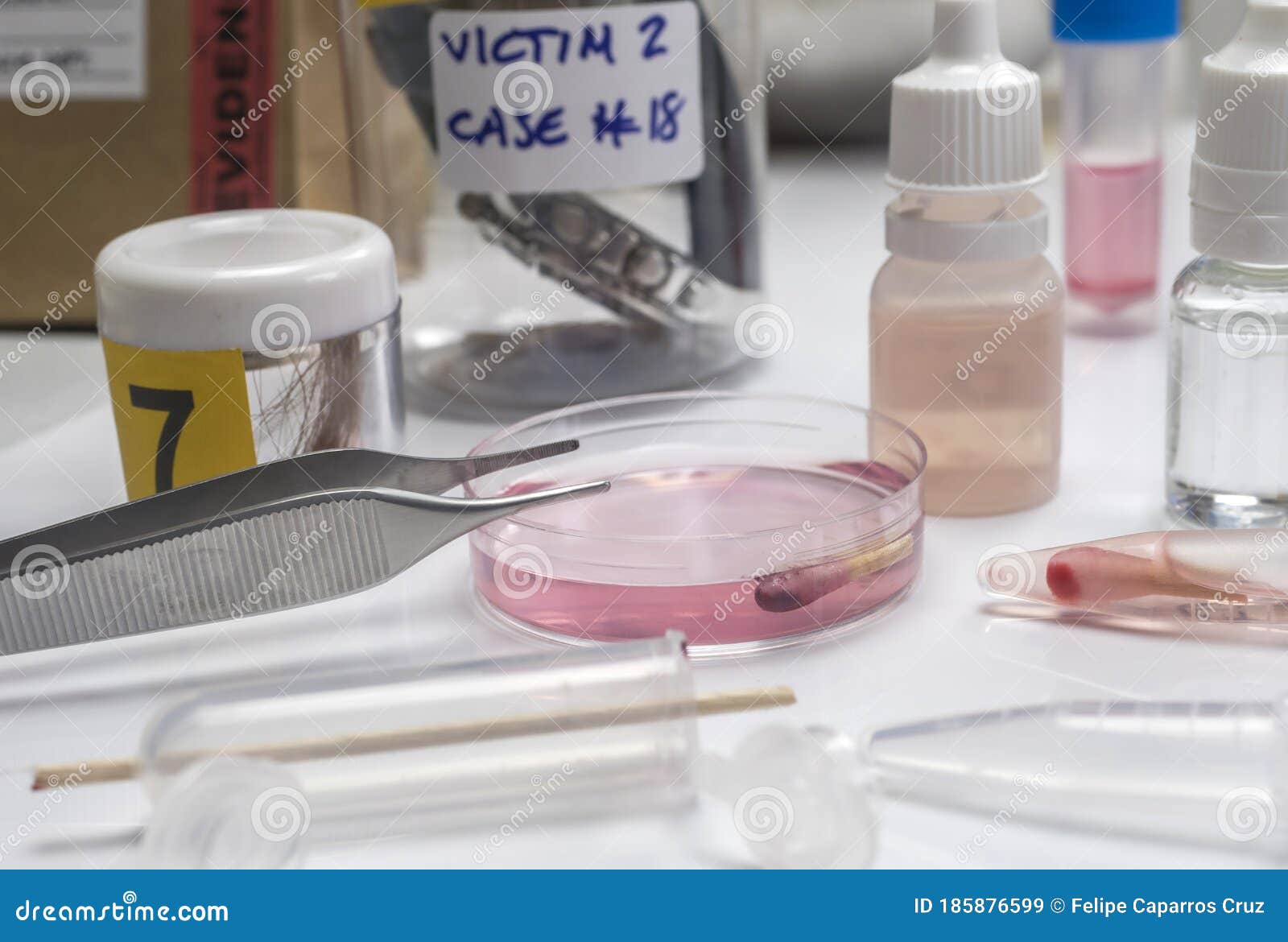 Hematological Analysis with Forensic Test Kit in a Murder in a Crime ...