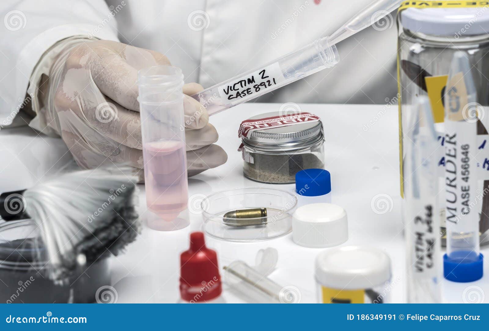 Hematological Analysis with Forensic Test Kit in a Murder in a Crime ...