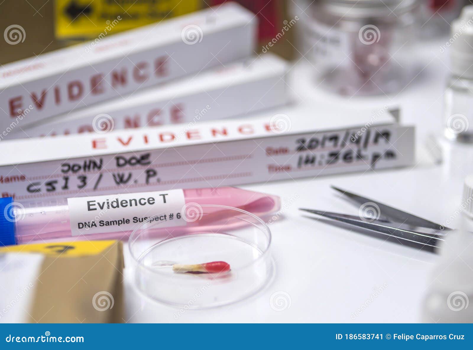 Hematological Analysis with Forensic Test Kit in a Murder in a Crime ...