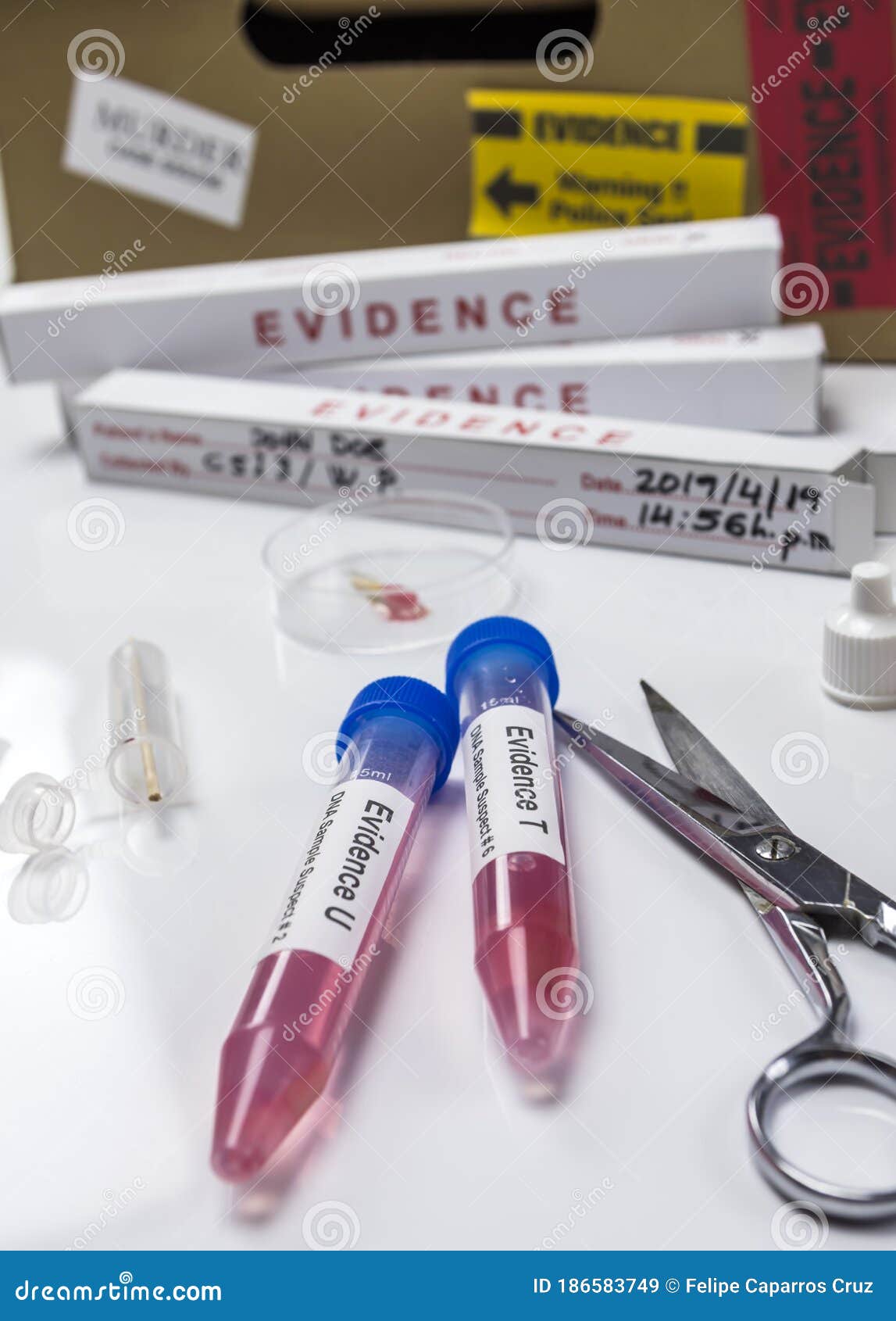 Hematological Analysis with Forensic Test Kit in a Murder in a Crime ...