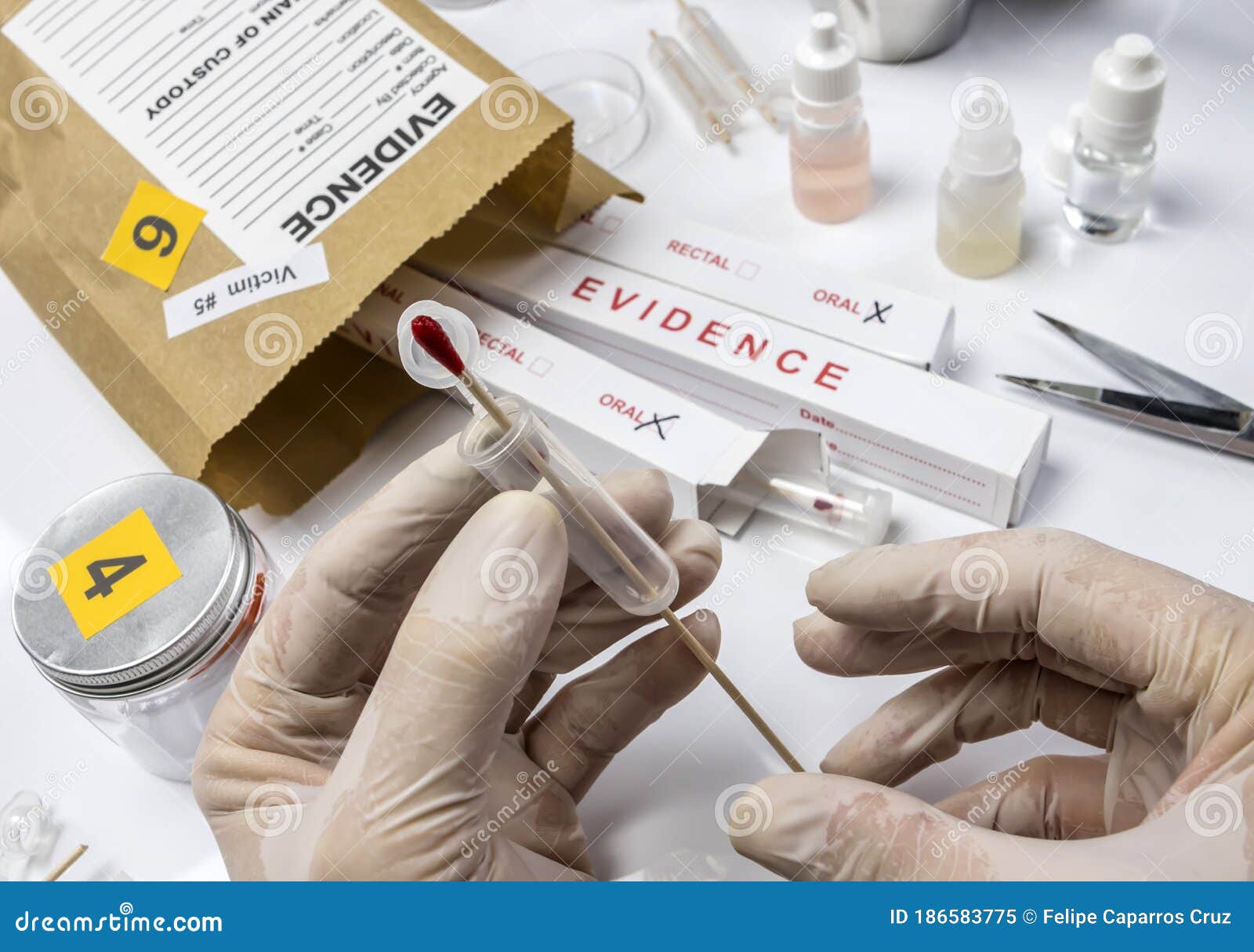 Hematological Analysis with Forensic Test Kit in a Murder in a Crime ...
