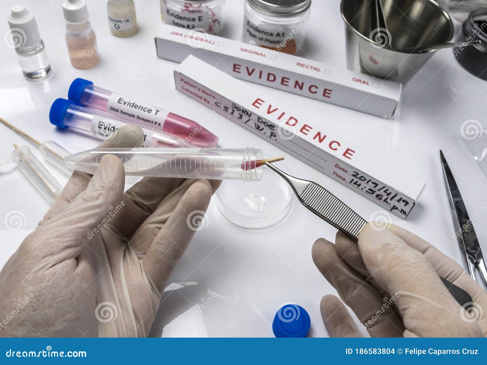 Hematological Analysis with Forensic Test Kit in a Murder in a Crime ...
