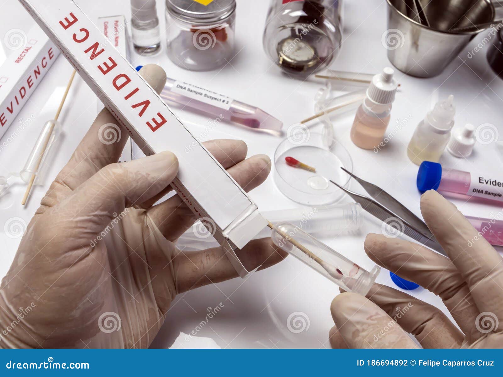 Hematological Analysis with Forensic Test Kit in a Murder in a Crime ...