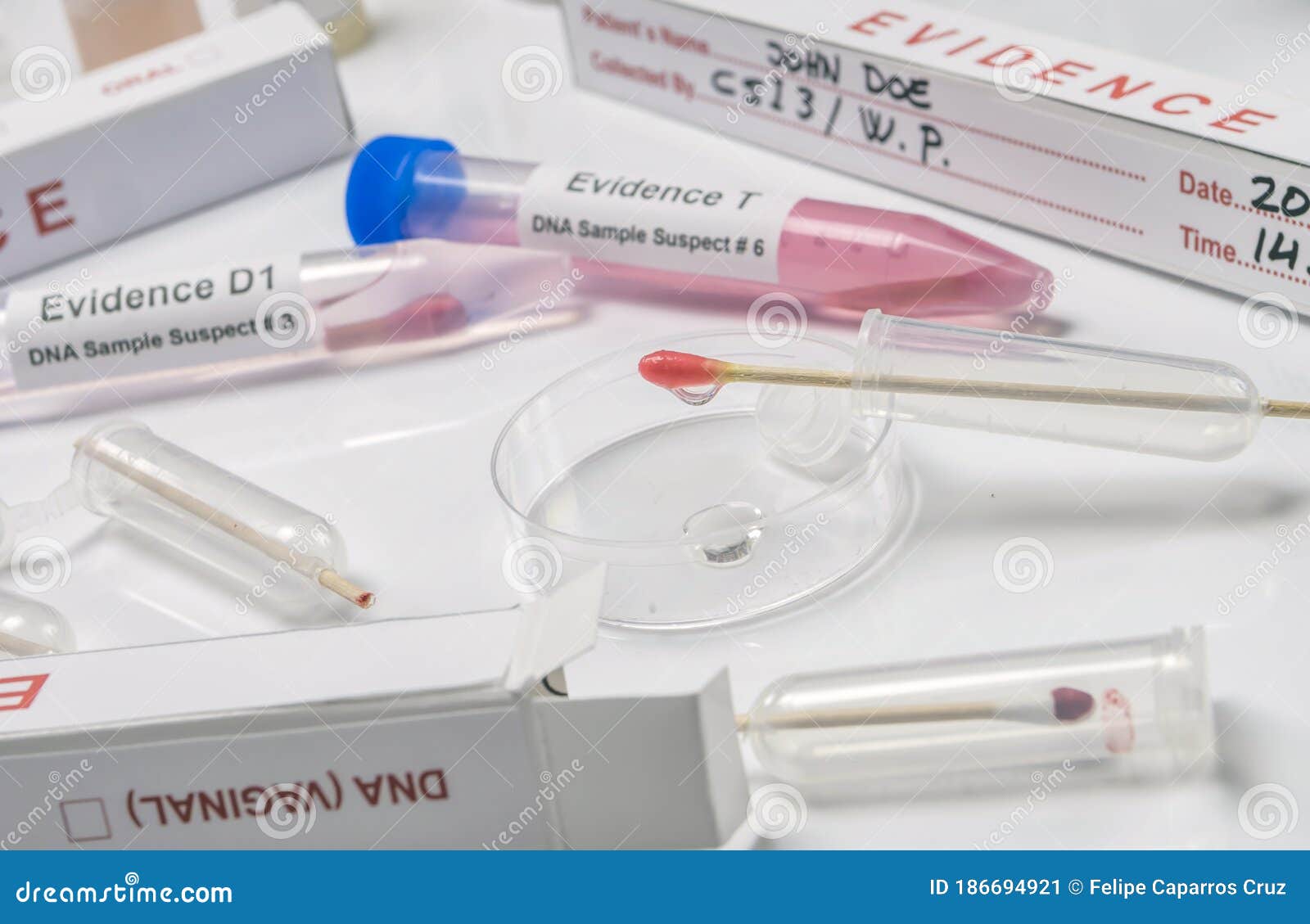 Hematological Analysis with Forensic Test Kit in a Murder in a Crime ...