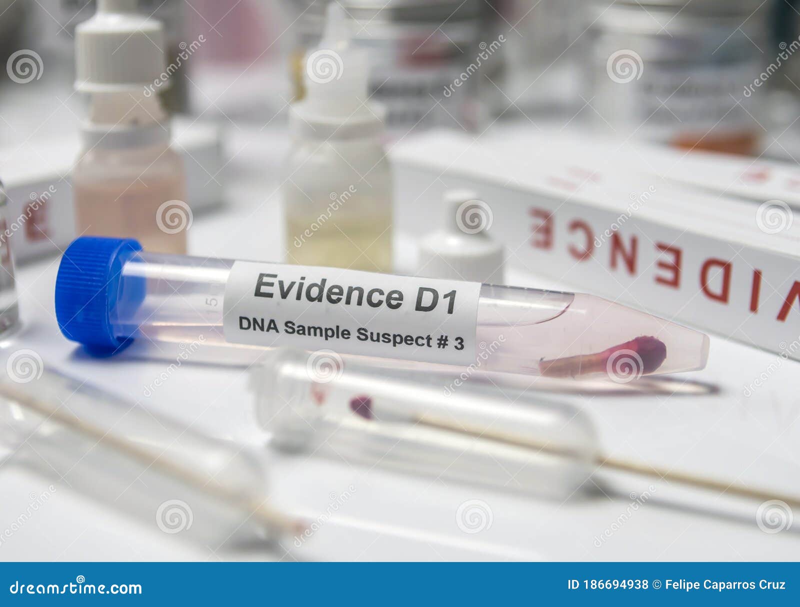 Hematological Analysis with Forensic Test Kit in a Murder in a Crime ...