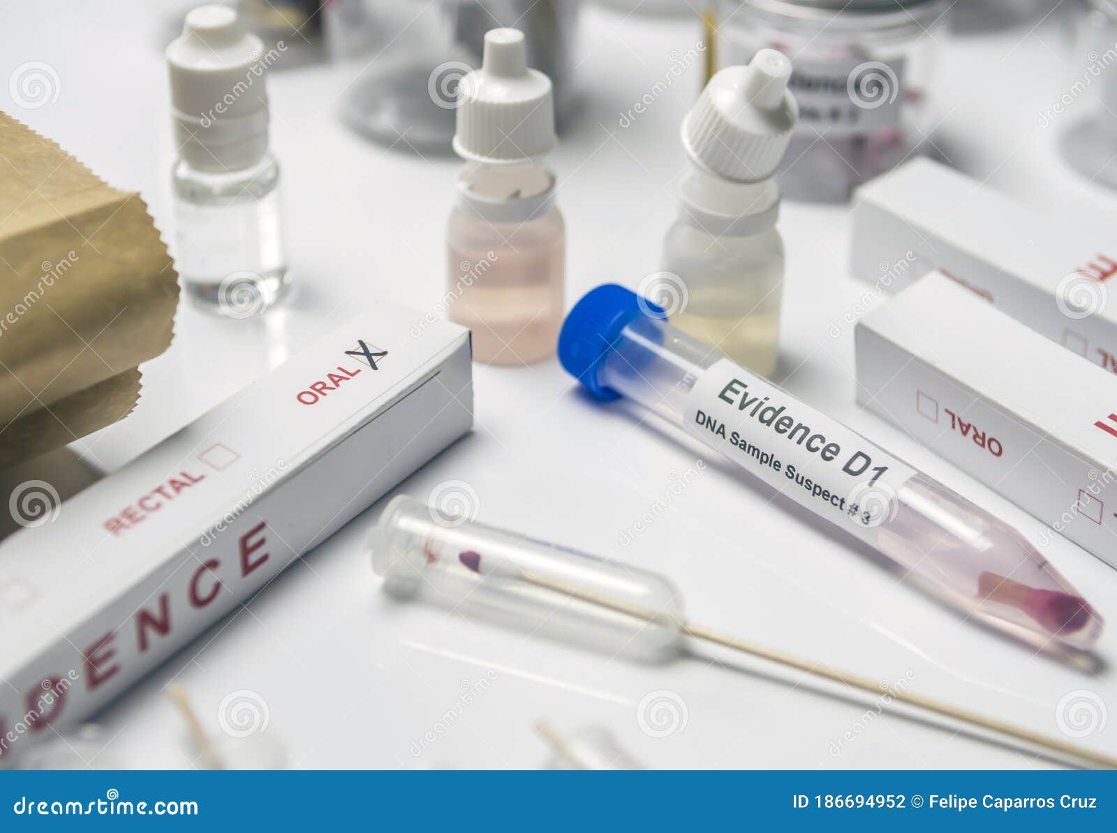 Hematological Analysis with Forensic Test Kit in a Murder in a Crime ...