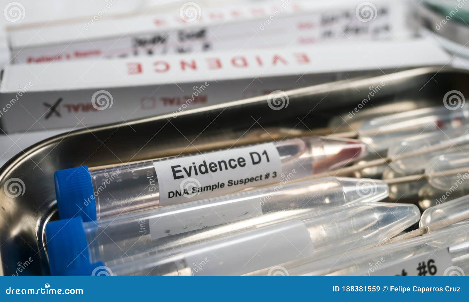 Hematological Analysis with Forensic Test Kit in a Murder in a Crime ...