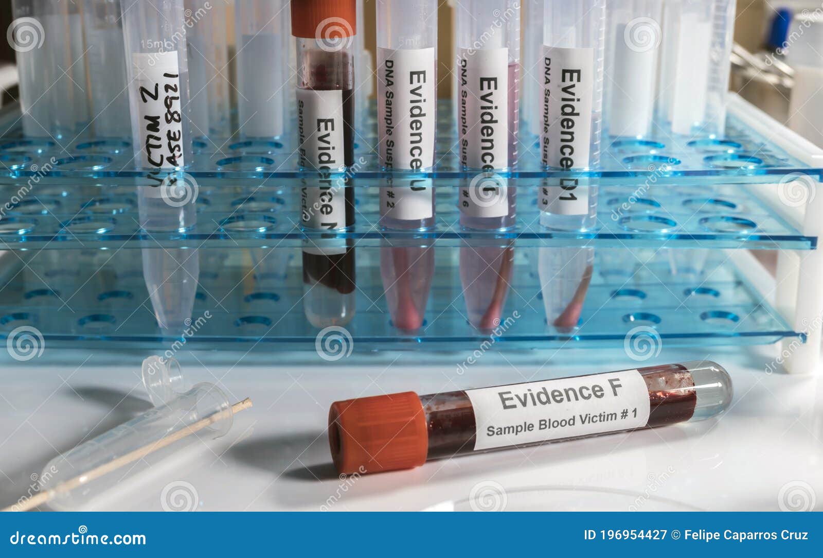 Hematological Analysis with Forensic Test Kit in a Murder in a Crime ...