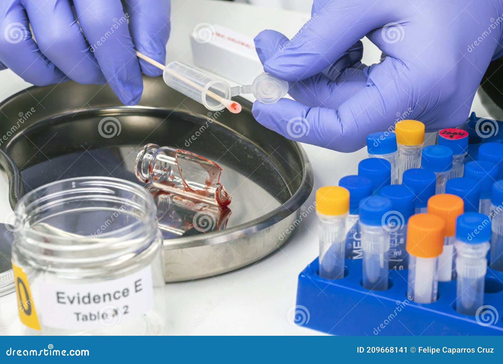 Hematological Analysis with Forensic Test Kit in a Murder in a Crime ...