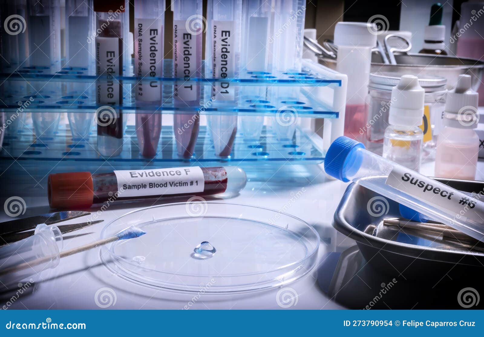 Hematological Analysis with Forensic Test Kit in a Murder in a Crime ...