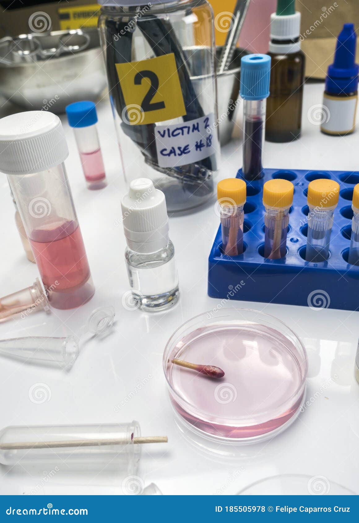 Hematological Analysis with Forensic Test Kit in a Murder in a Crime ...