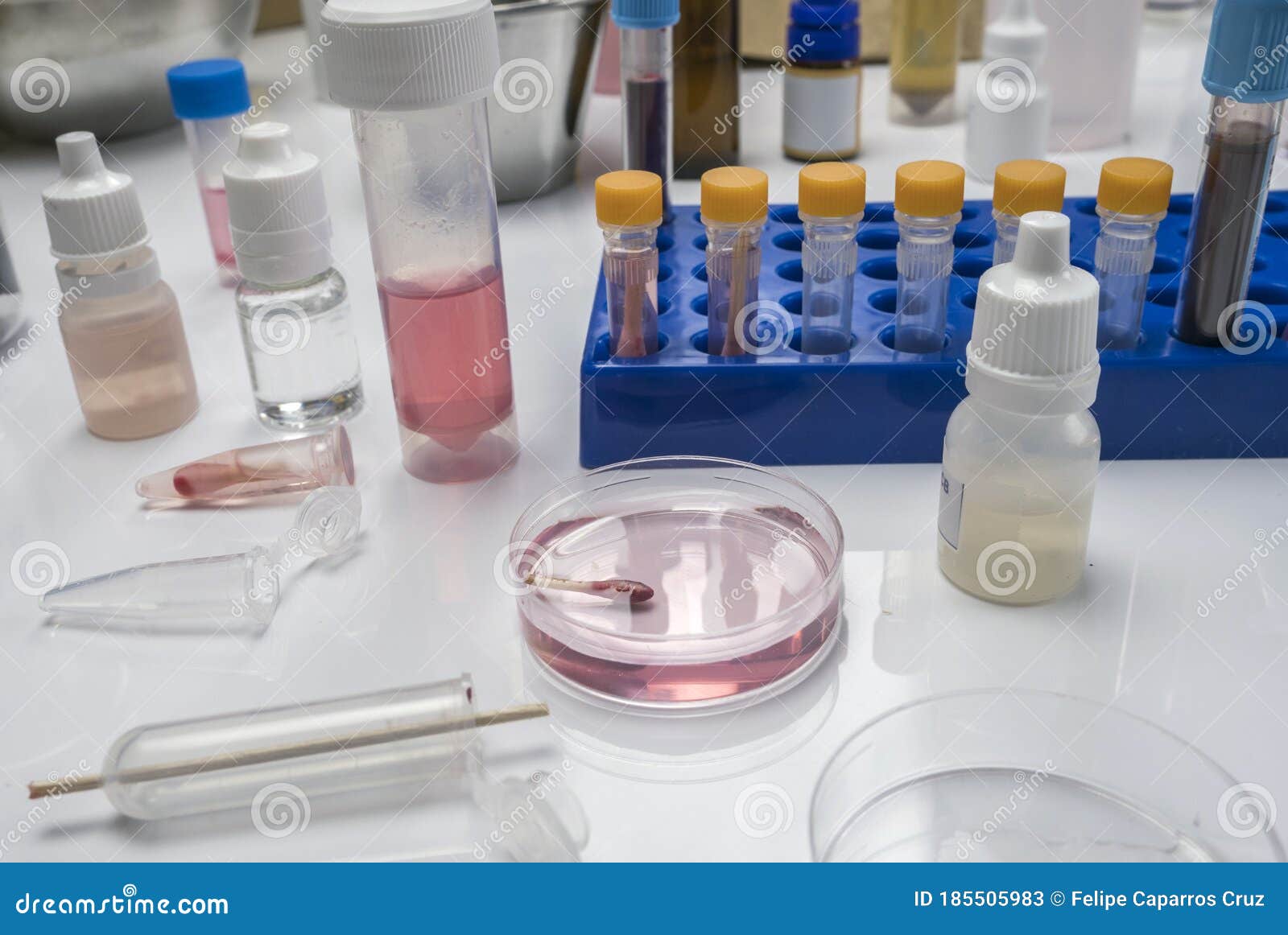 Hematological Analysis with Forensic Test Kit in a Murder in a Crime ...