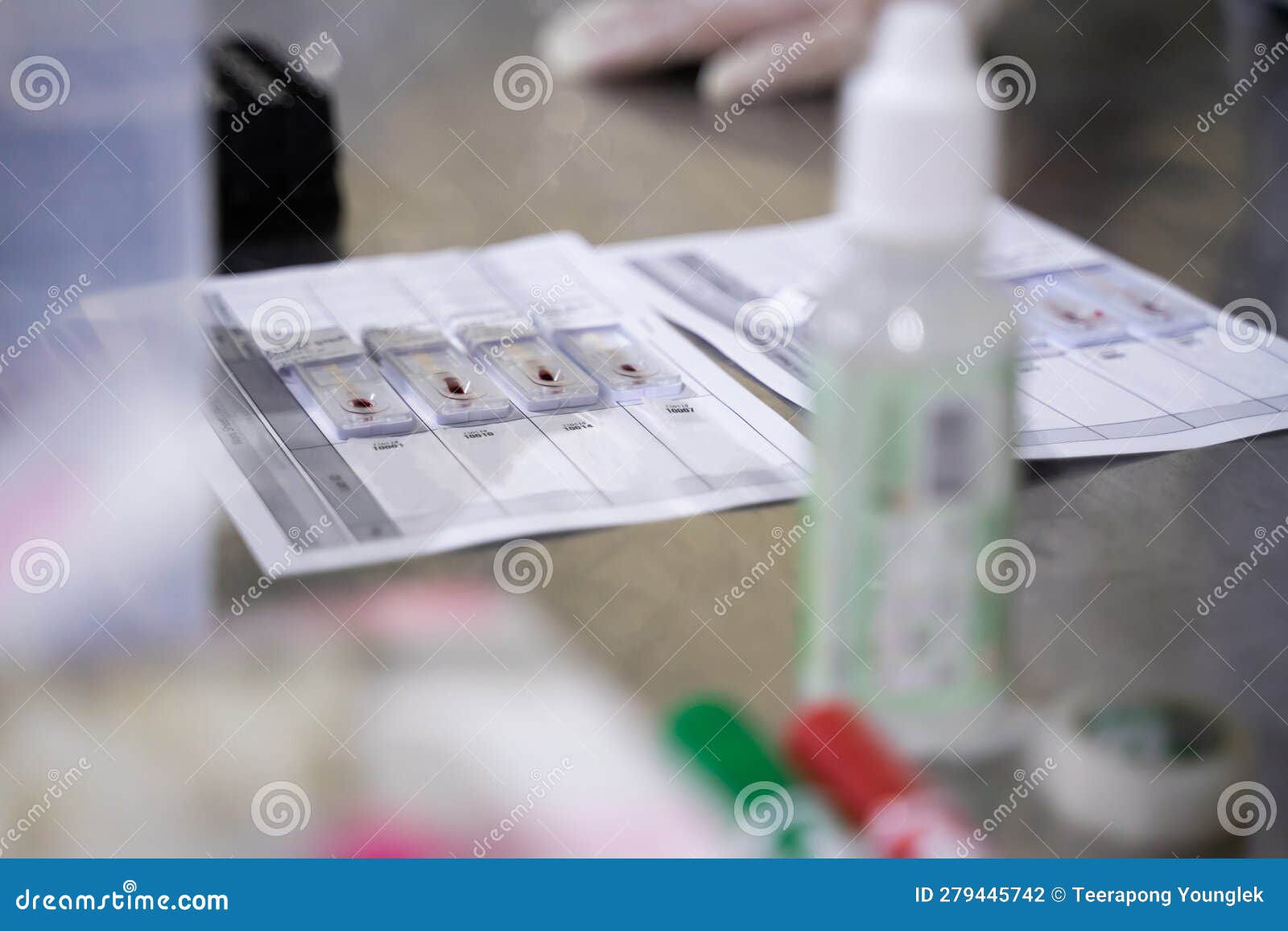 Hematology Analysis Report Medical Diagnosis Stock Photo - Image of ...