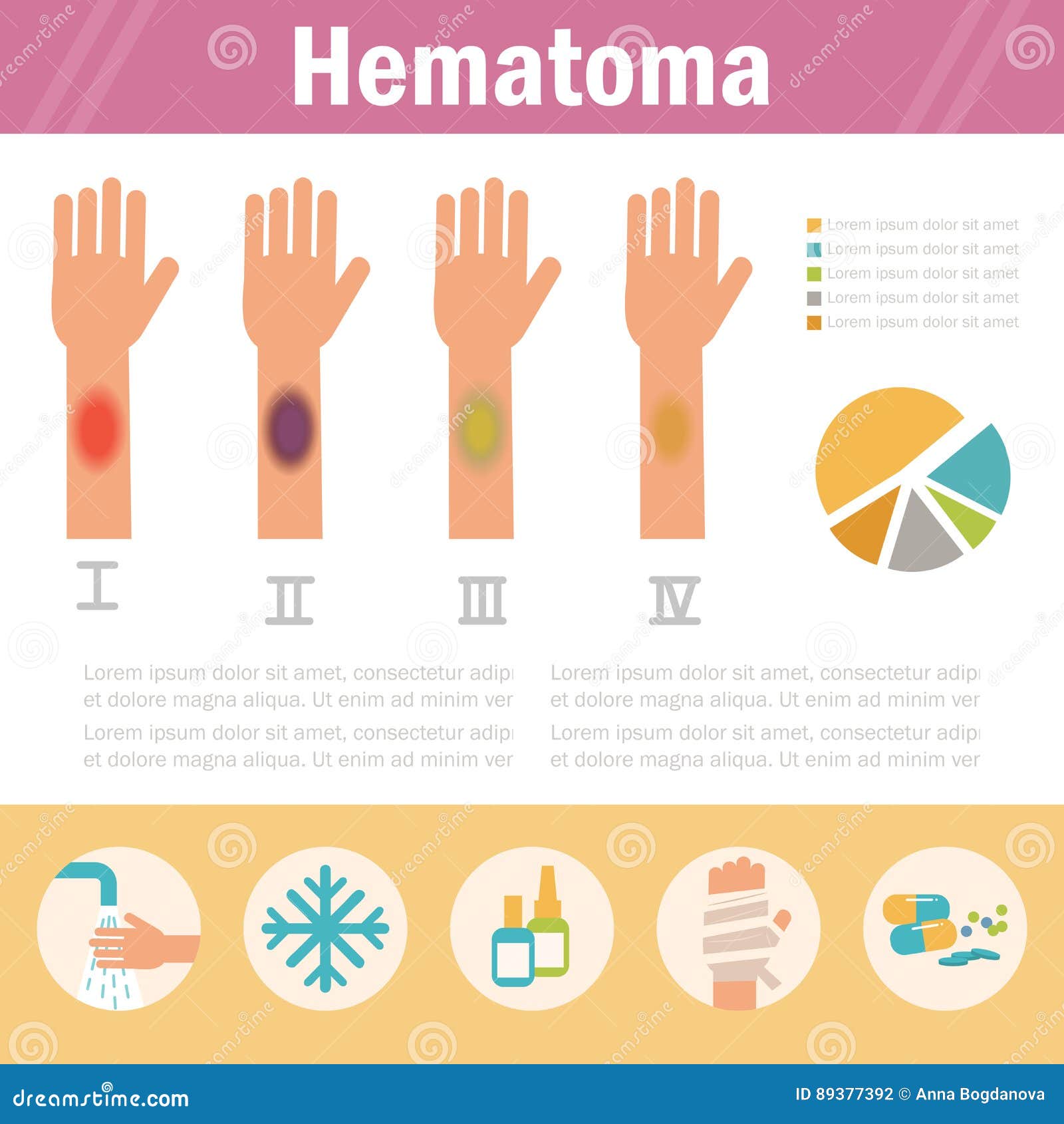 Hematoma estágios Isolado ilustração do vetor. Ilustração de liso ...