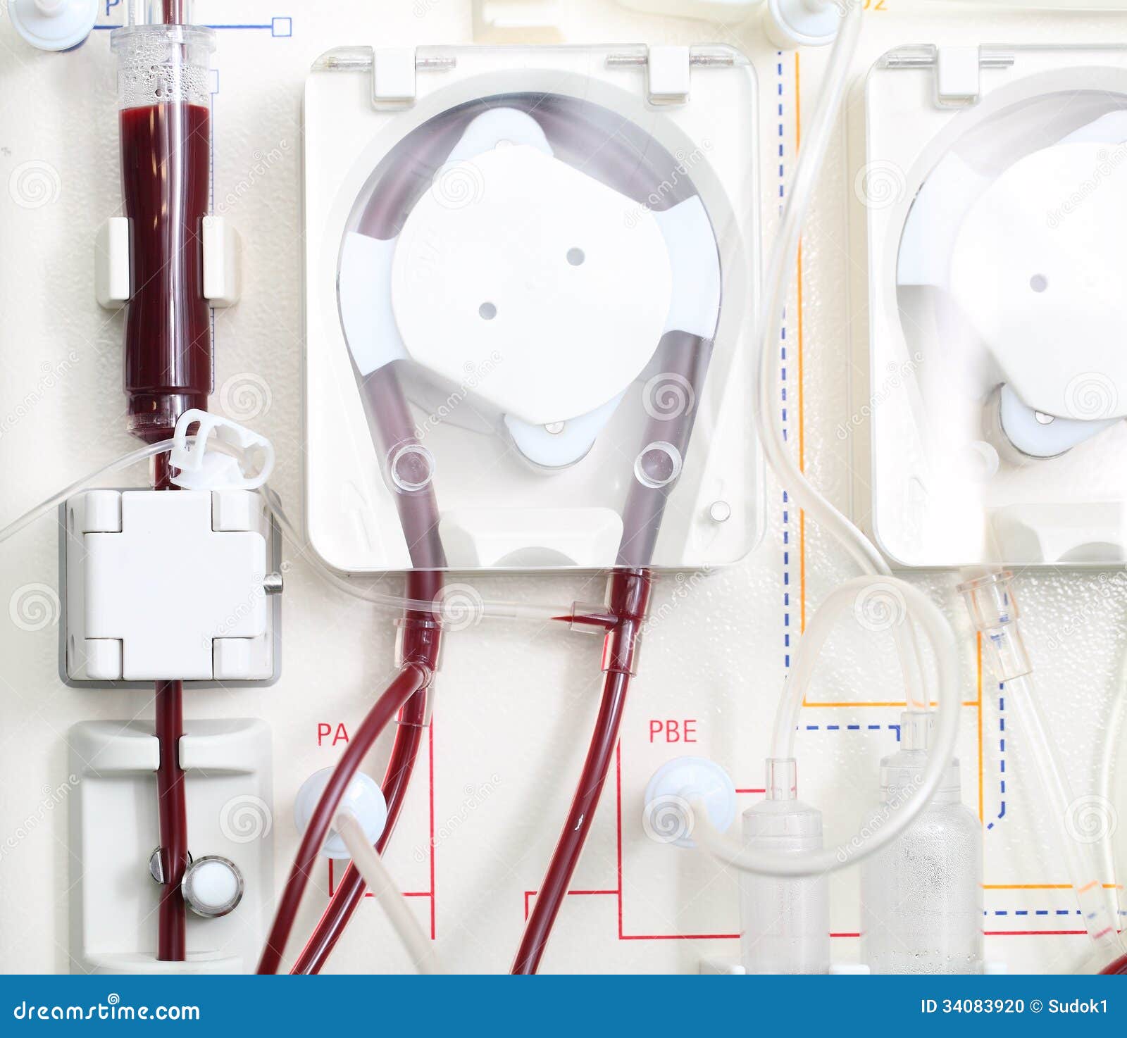Hemodialysis Machine At Work. Stock Photo - Image: 34083920