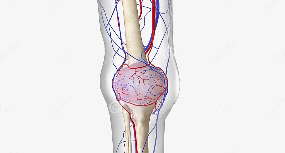 The Hemophilia, Bleeding into Joint Stock Illustration - Illustration ...