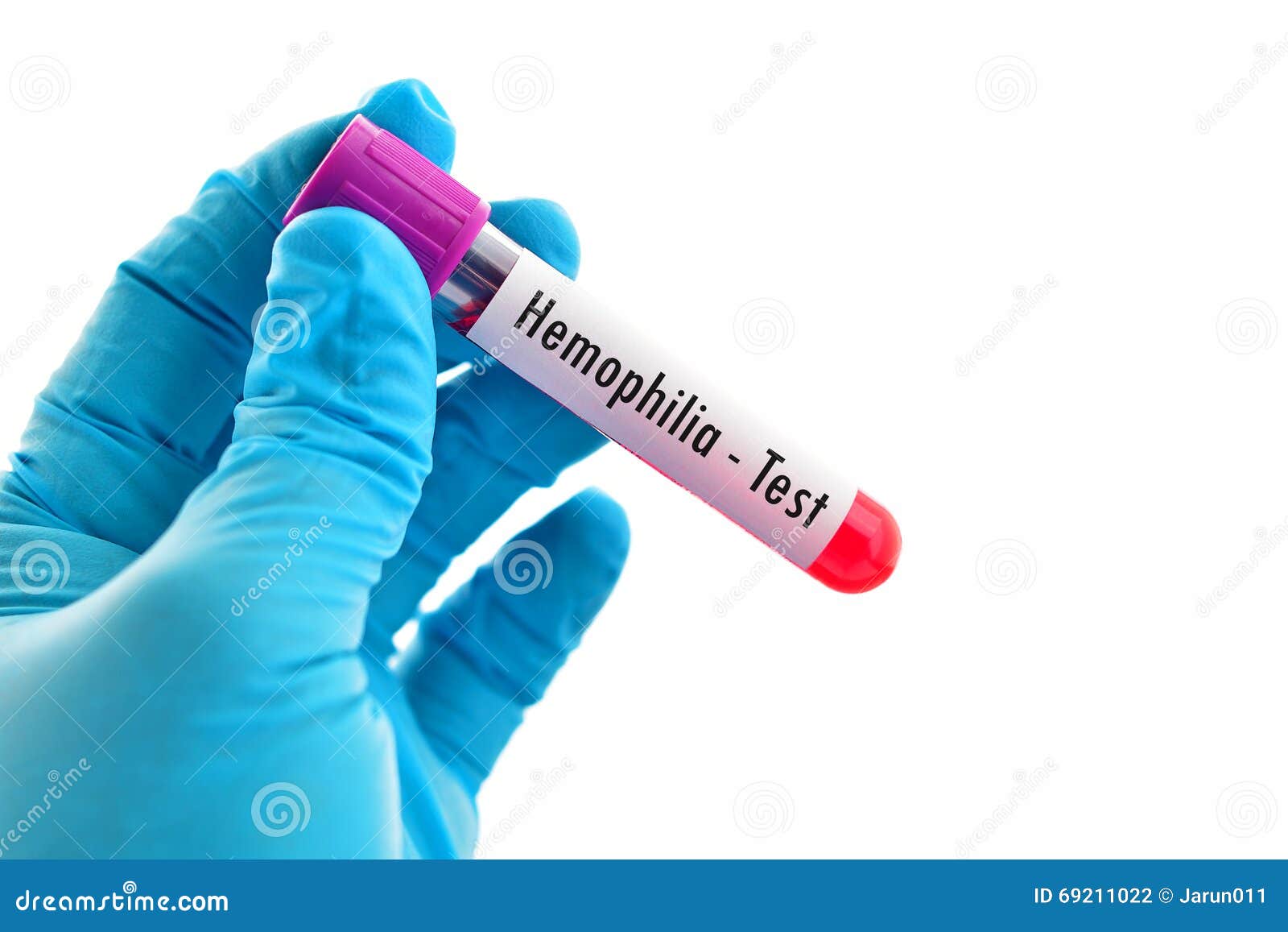 Hemophilia test stock photo. Image of checkup, count - 69211022