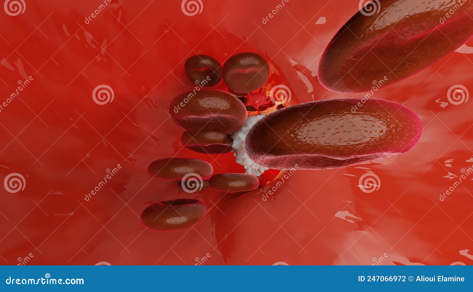 Hemostasis. Red Blood Cells and Platelets in the Blood Vessel. Basic ...