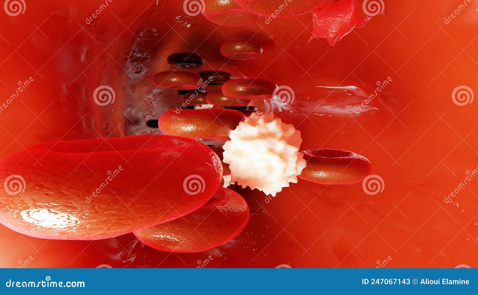 Hemostasis. Red Blood Cells and Platelets in the Blood Vessel. Basic ...
