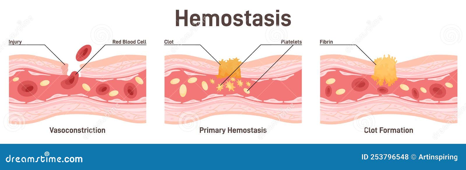 Hemostasis. Wound Healing Process Stages, Vasoconstriction And Vector ...
