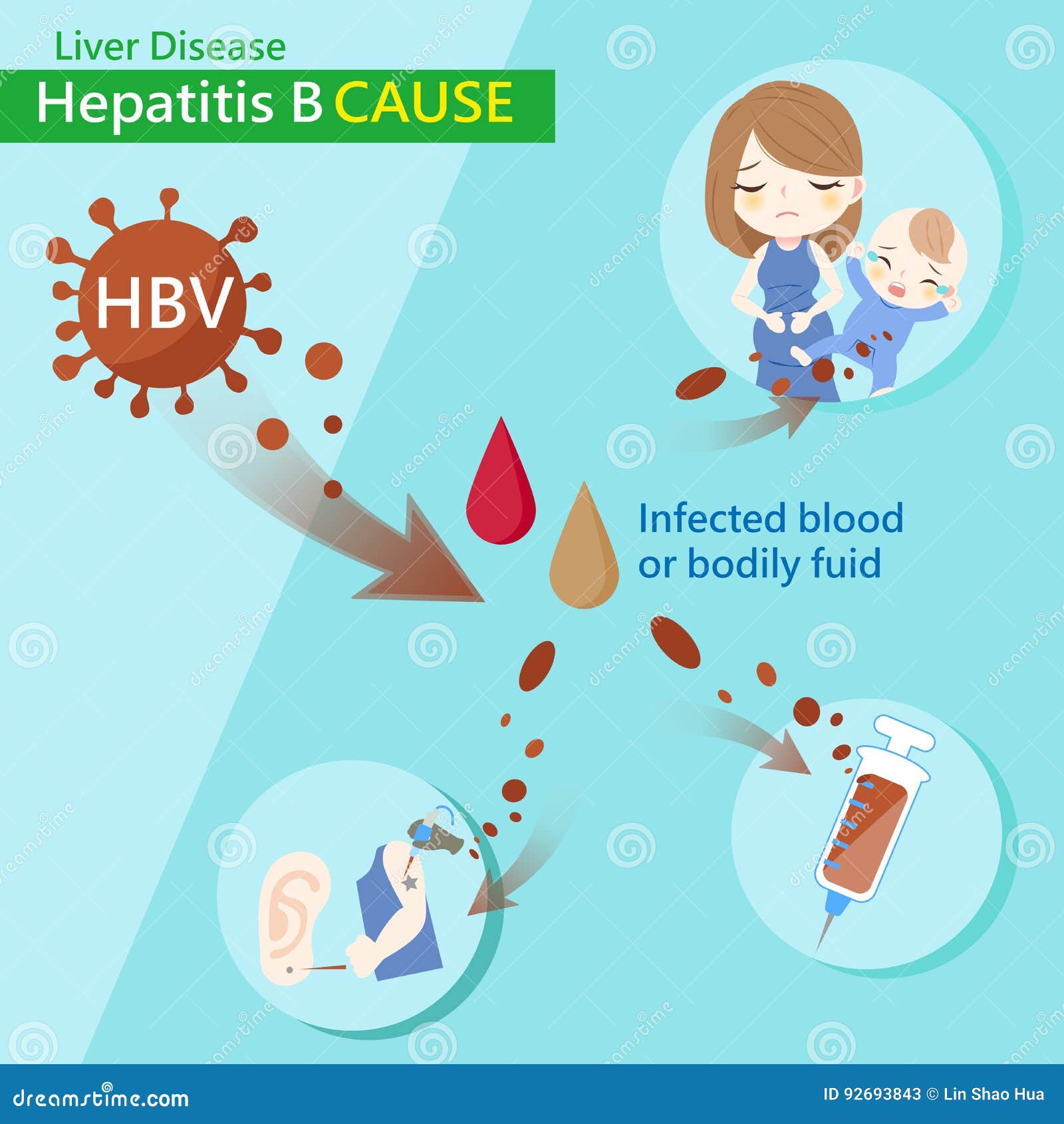 Hepatitis b cause stock vector. Illustration of healthy - 92693843