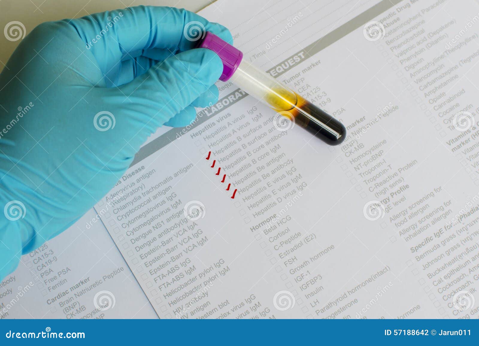 Hepatitis B testing stock photo. Image of infection, research - 57188642