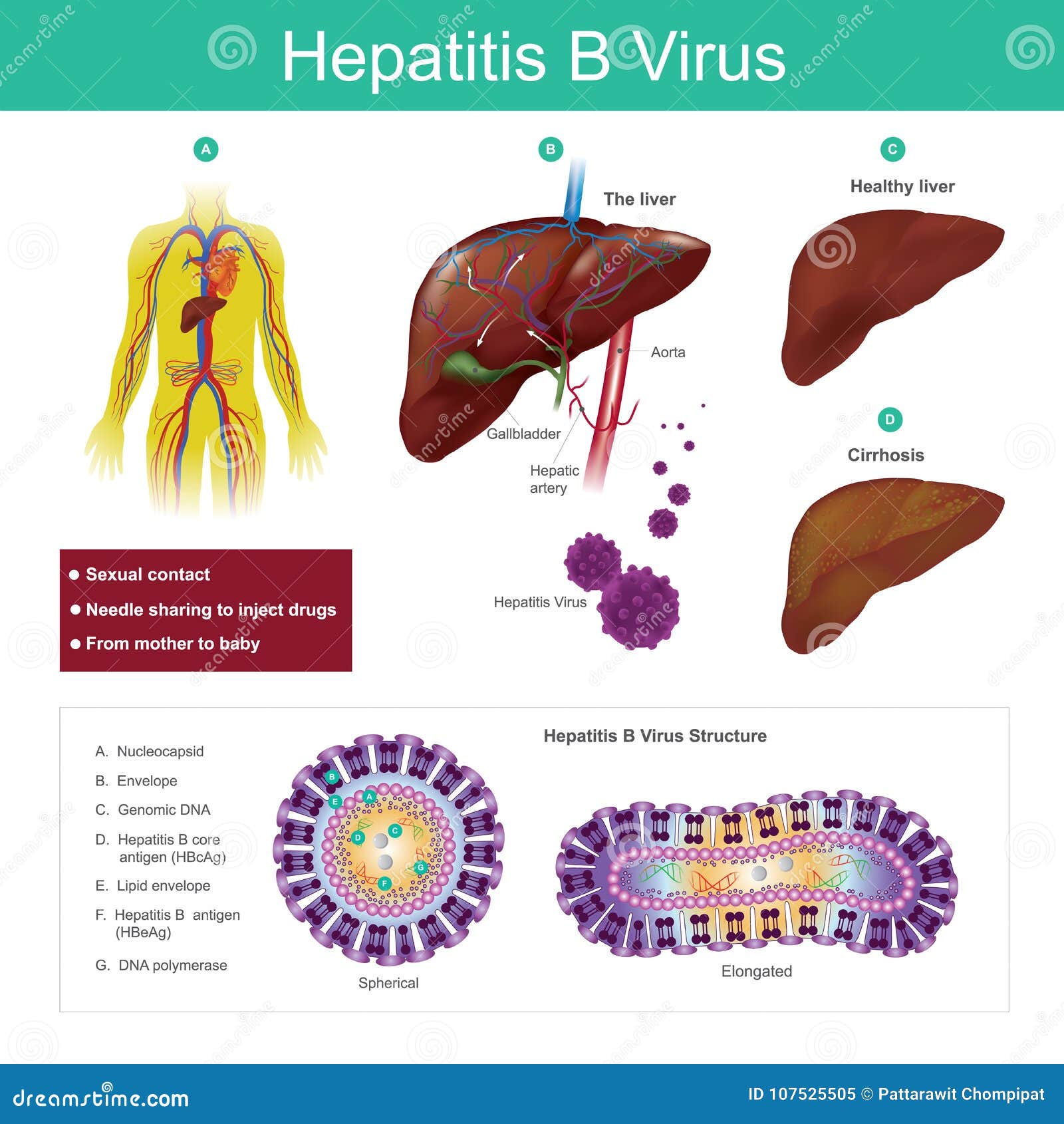 Hepatitis Ways Of Transmission Illustrations Stock Vector Art Hot Sex