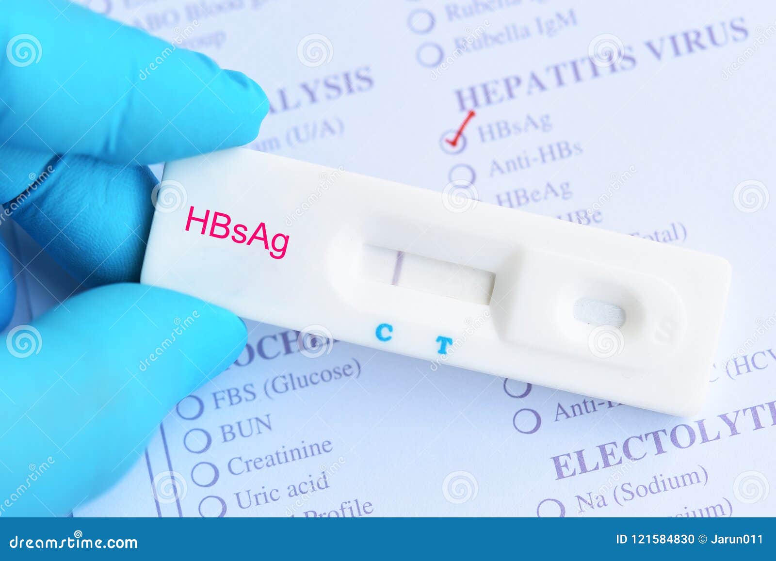 Hepatitis B Virus Negative Test Result Stock Photo - Image of fever ...
