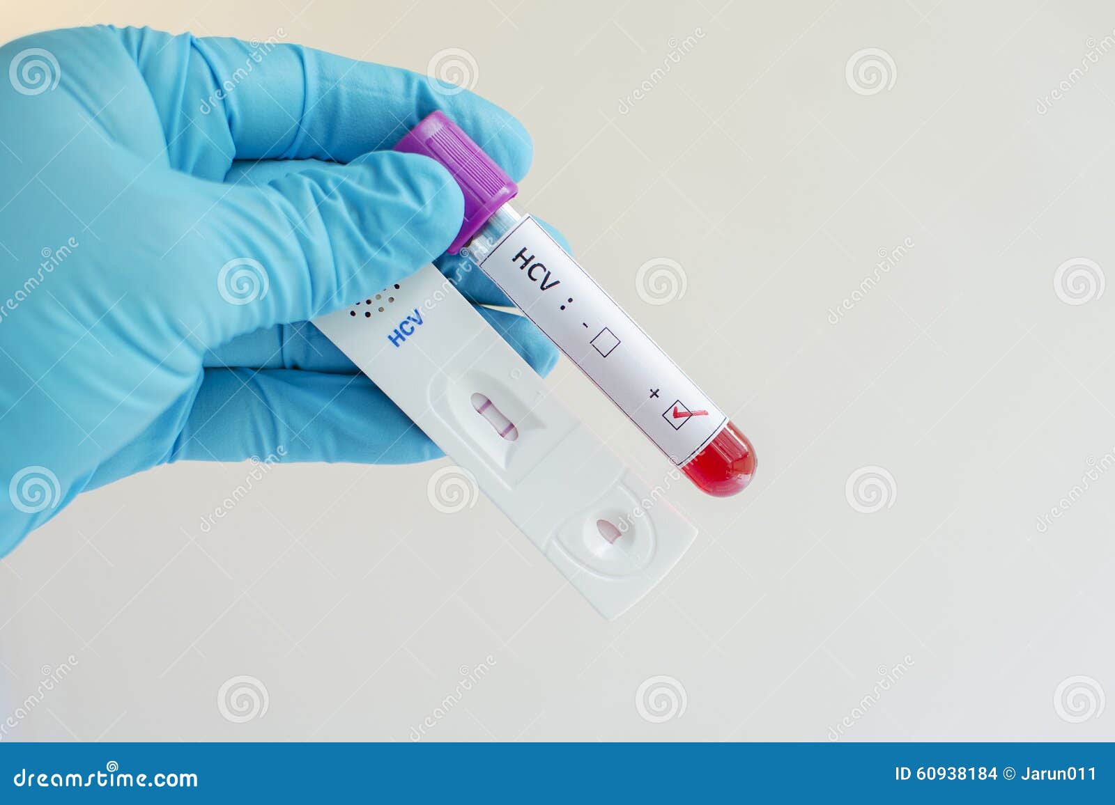 Hepatitis C Virus (HCV) Positive Stock Photo - Image of infection ...